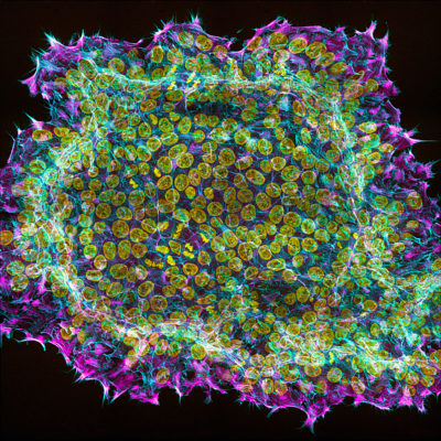 Human embryonic stem cell colony | Nikon Small World