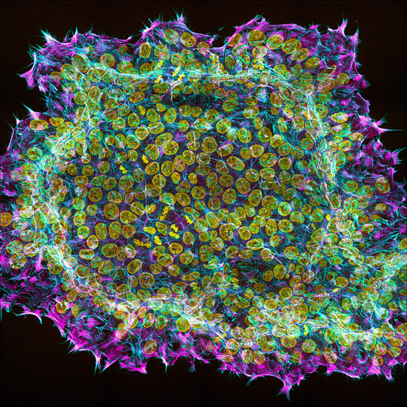Human Embryonic Stem Cell Colony Nikon s Small World Human Embryonic Stem Cell Colony Nikon s Small World