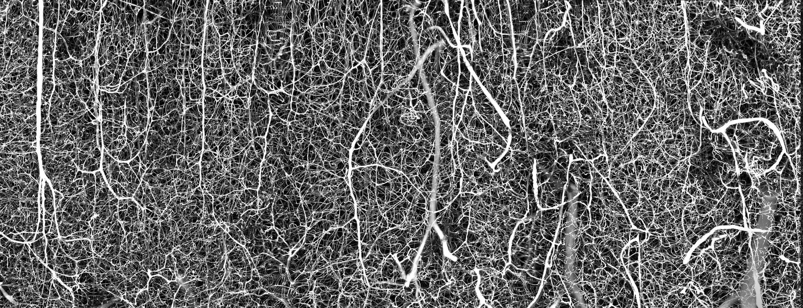 3D vasculature of an adult mouse brain (somatosensory cortex) | Nikon ...