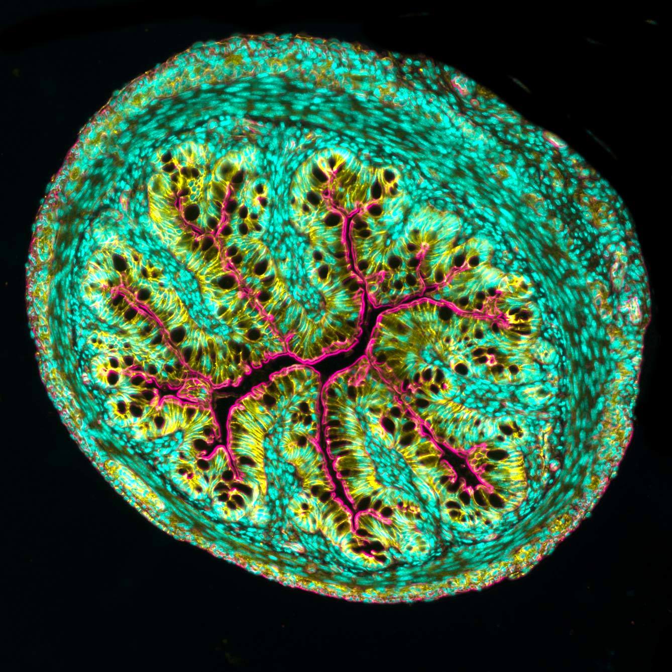 Cross section of mouse intestine | Nikon Small World