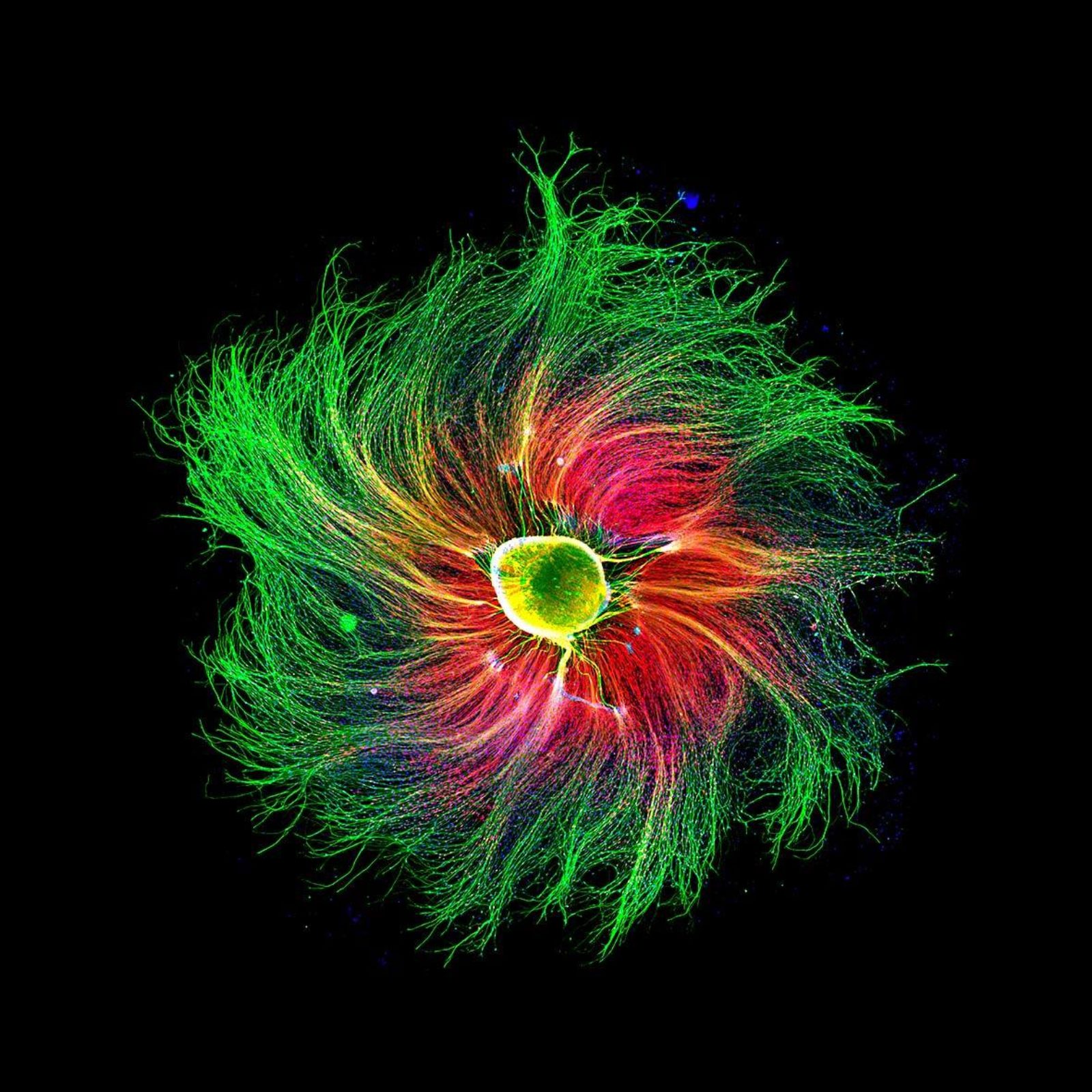 Sensory neuron from an embryonic rat | Nikon Small World