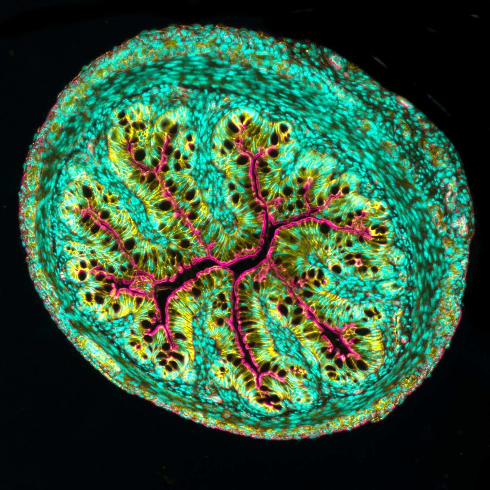 Cross section of mouse intestine | Nikon Small World