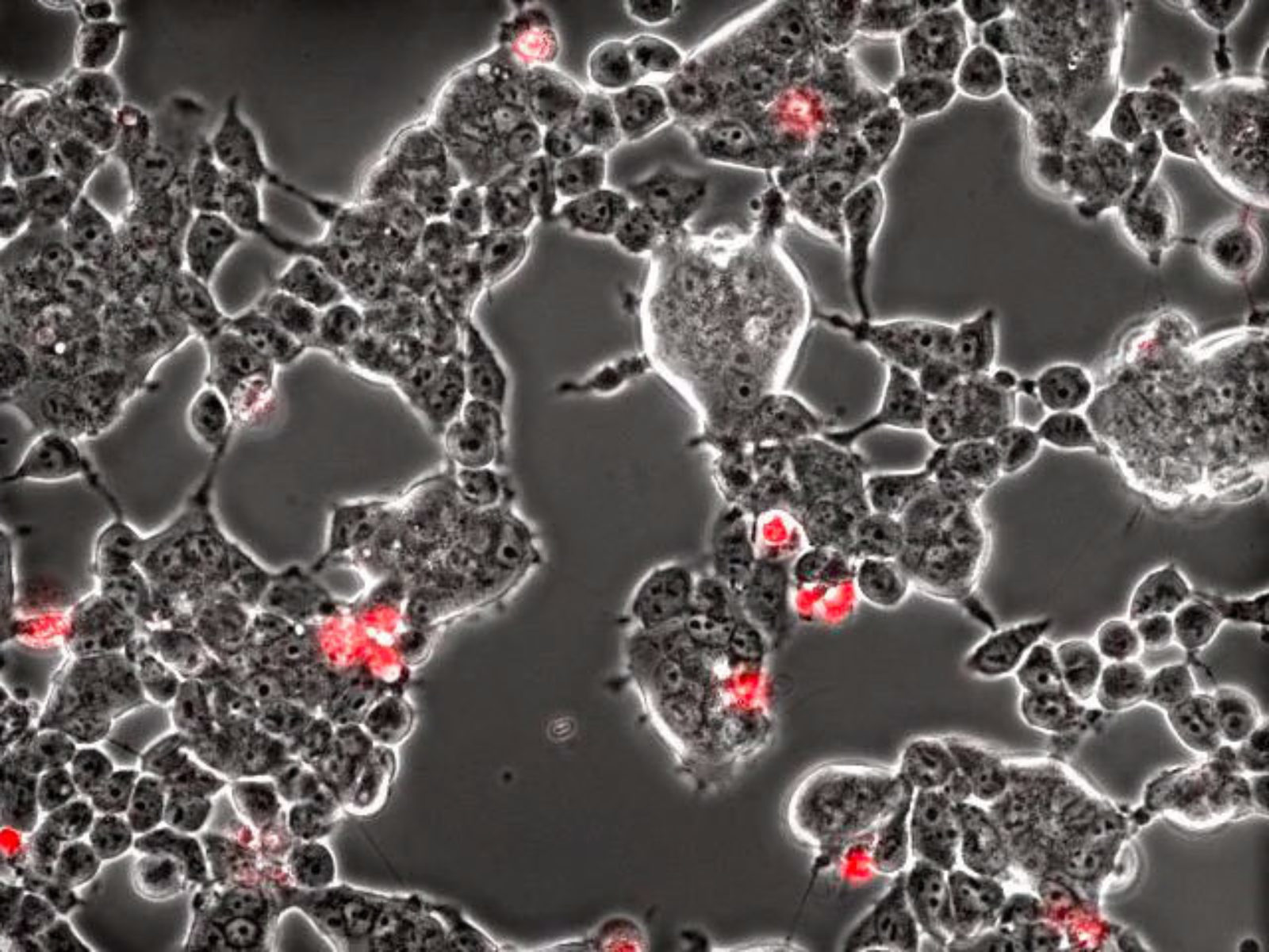 SARS-CoV-2 infection triggering cell fusion and cell death in bat brain ...