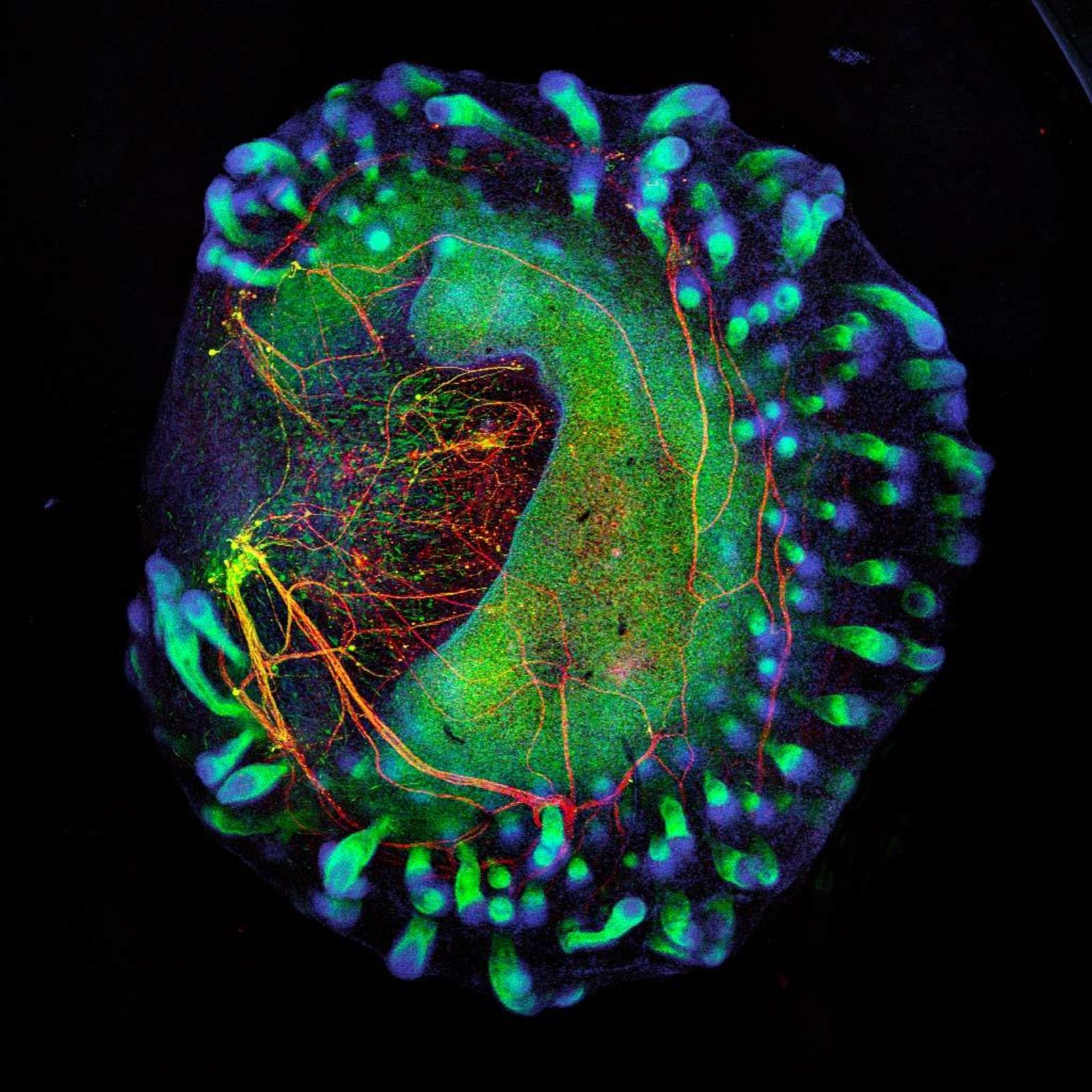 Stem cell-derived hairy human skin organoid (green) containing sensory ...