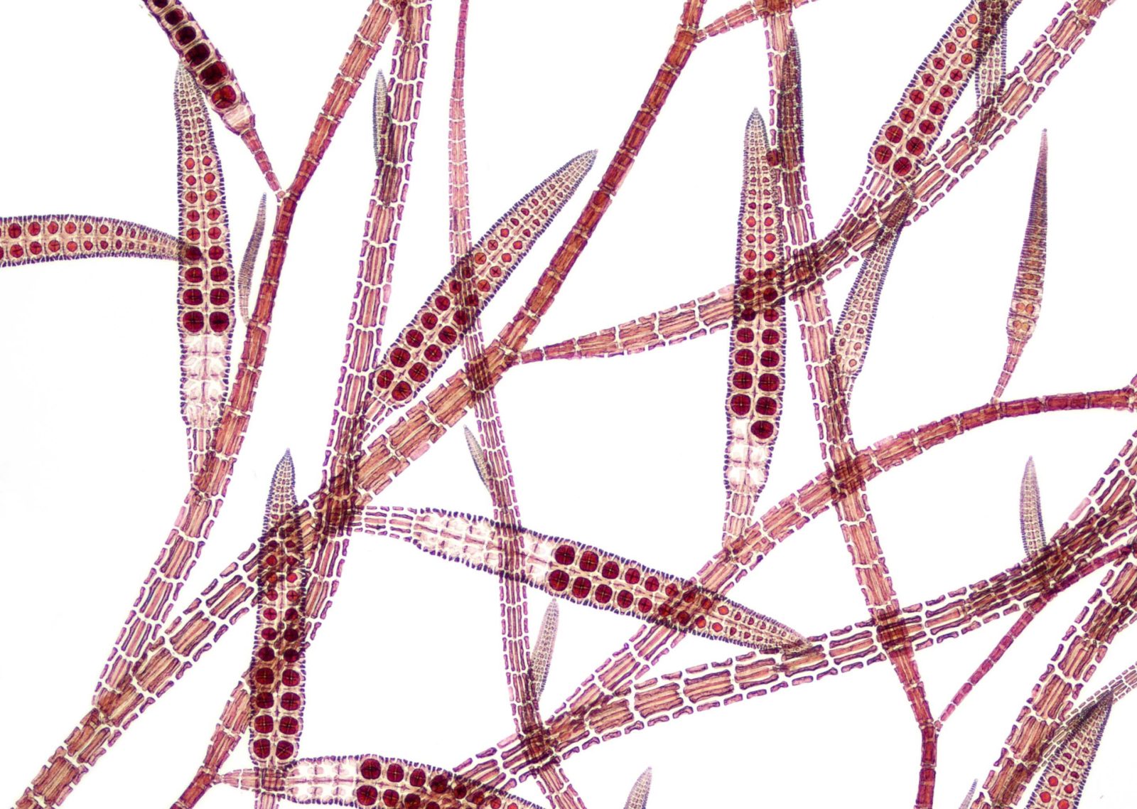 Reproductive structures of red seaweed | Nikon Small World
