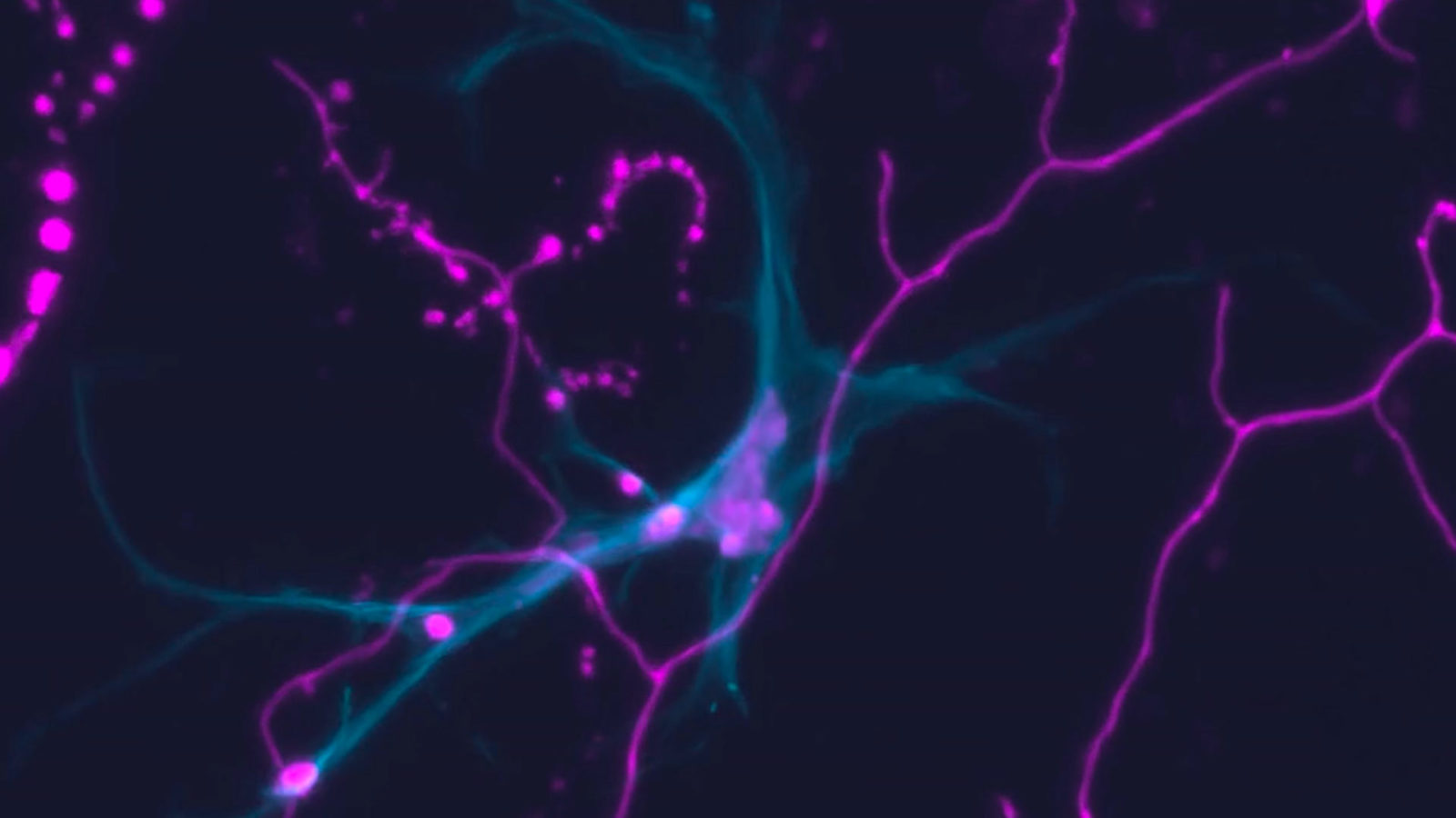 Debris from degenerating axons engulfed by an immune cell in zebrafish ...