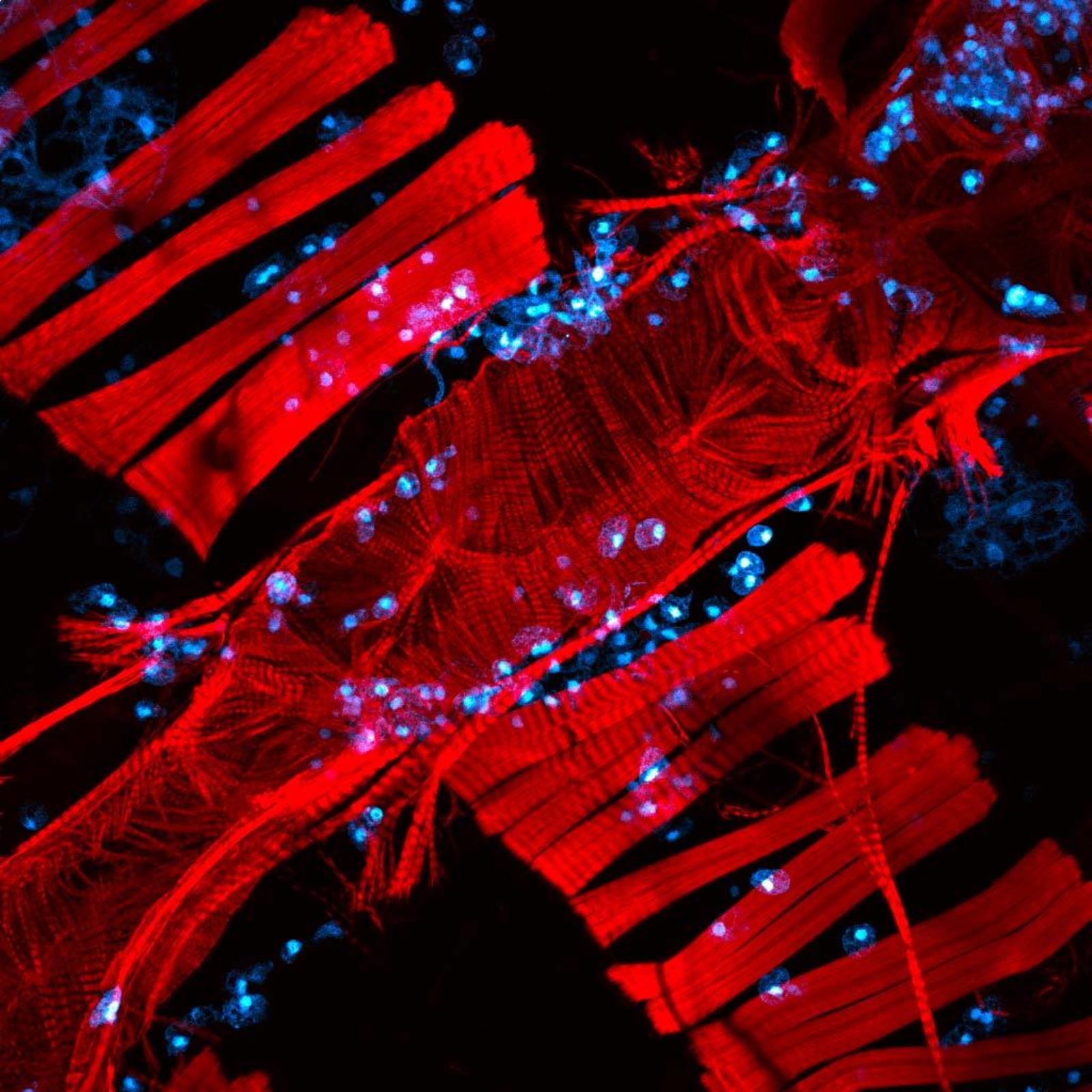 Blood cells associated with the heart of a fruit fly (Drosophila ...