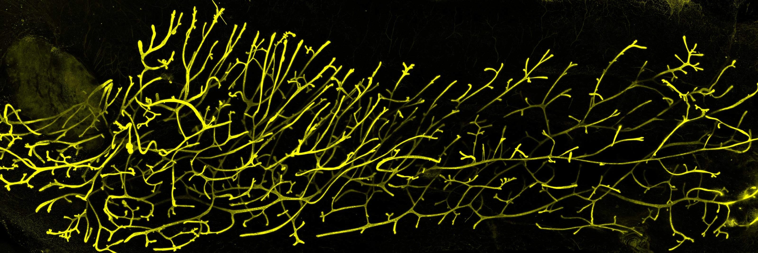 Mouse mammary gland ductal tree | Nikon Small World