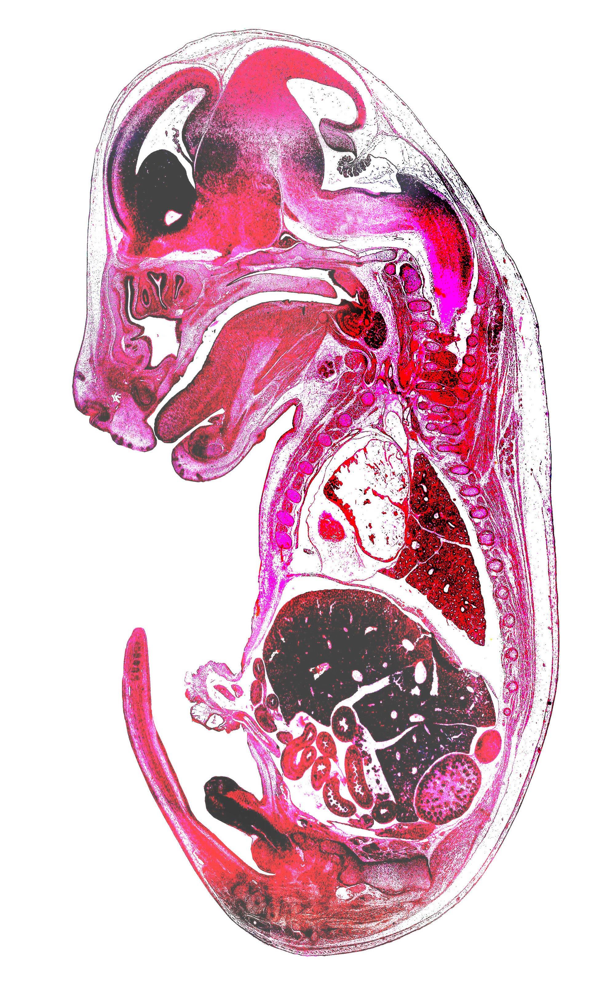 Embryo of a male rat | Nikon Small World