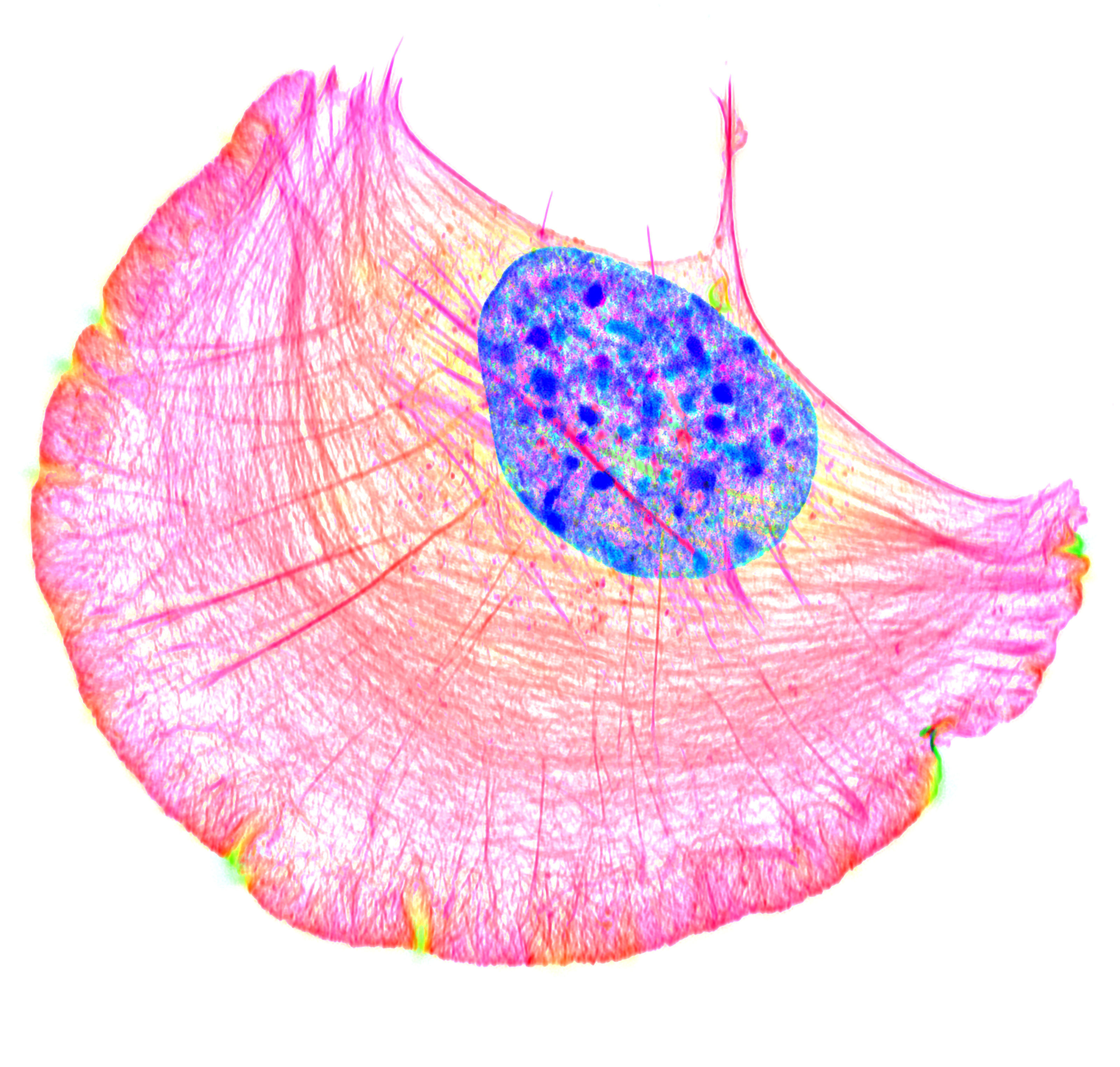 A crawling cell | Nikon Small World