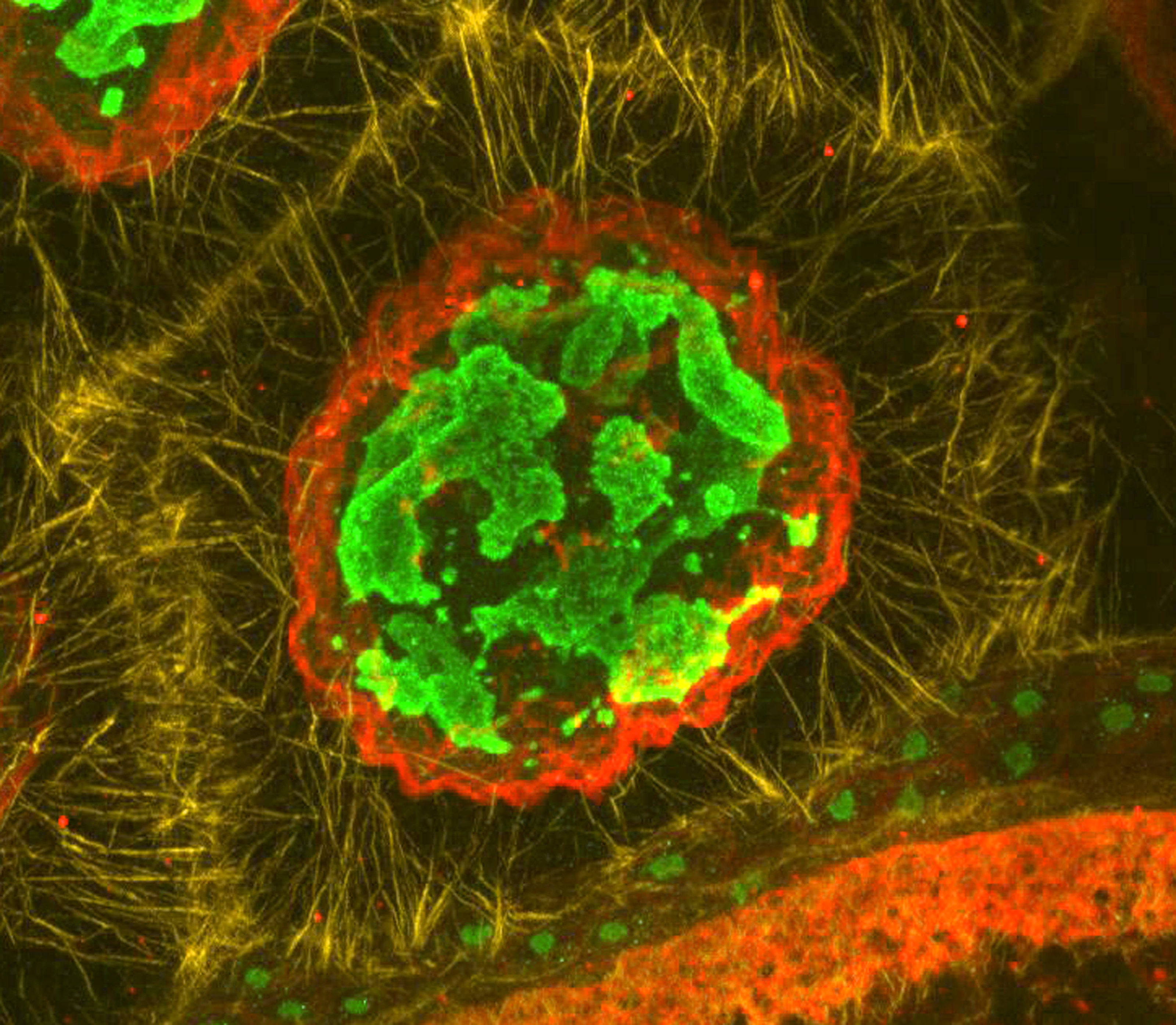 Nurse cell in a developing fruit fly (Drosophila) follicle | Nikon ...