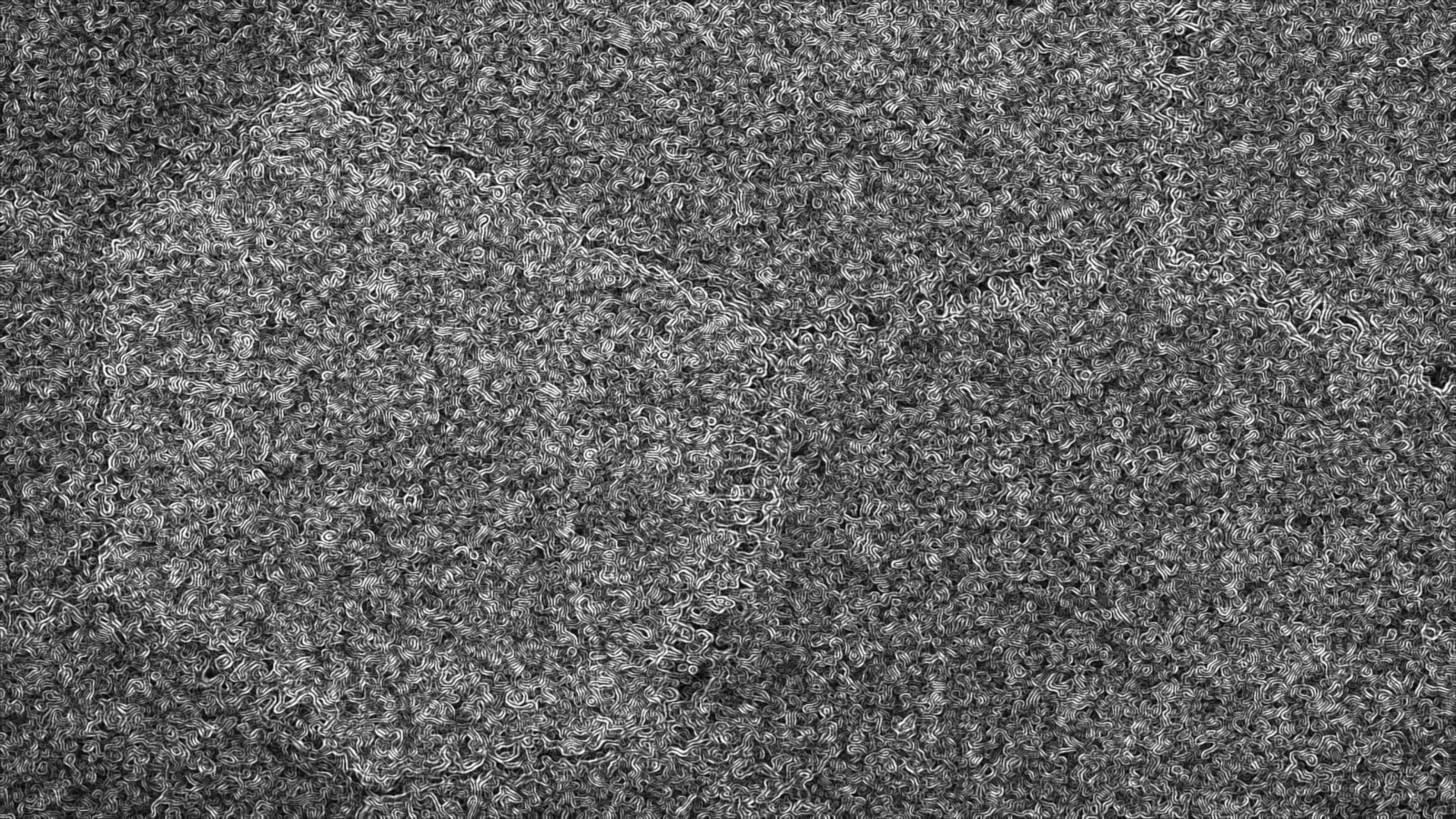 The actomyosin network at the apical pole of human corneal endothelial ...