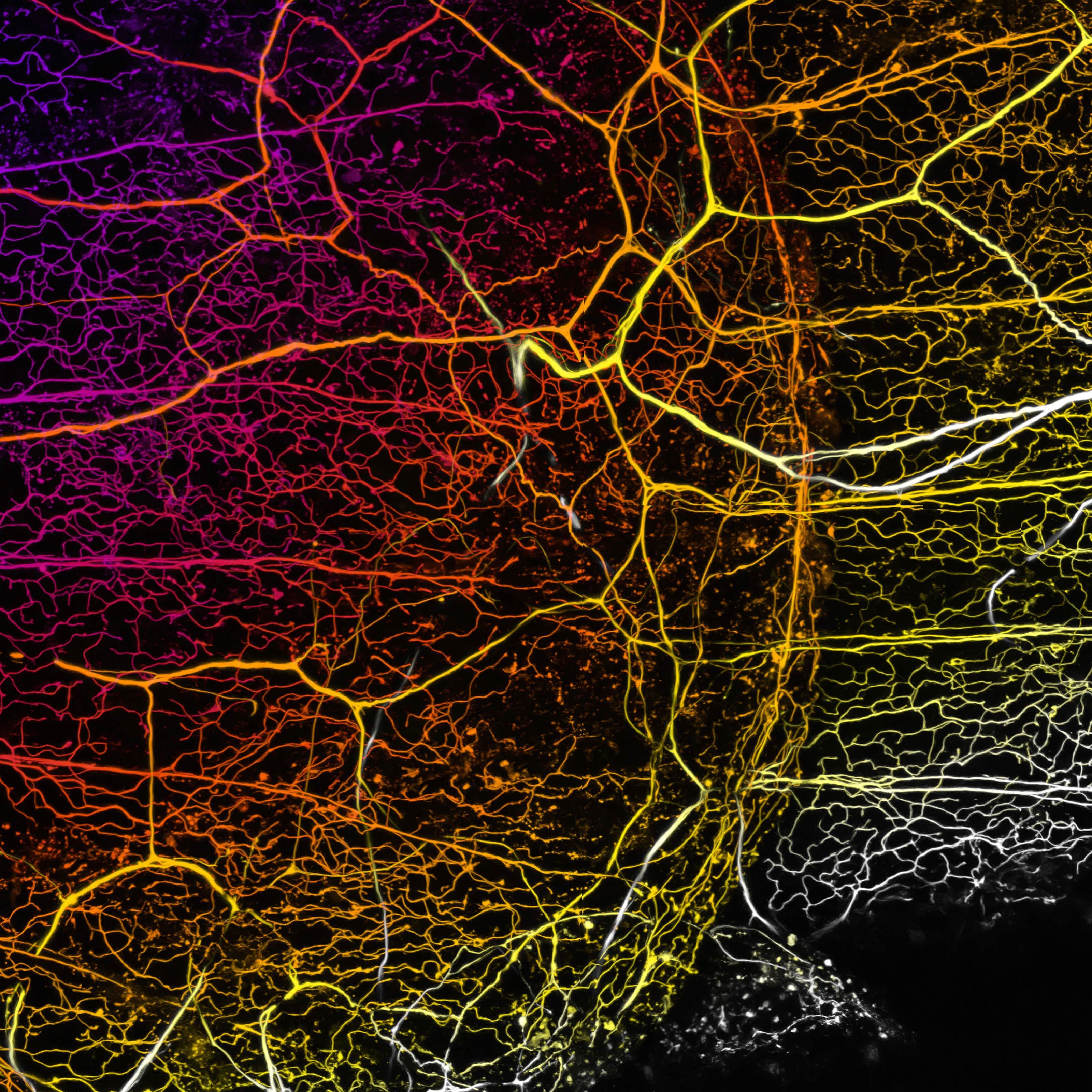 Nerve network within the skin of zebrafish | Nikon Small World