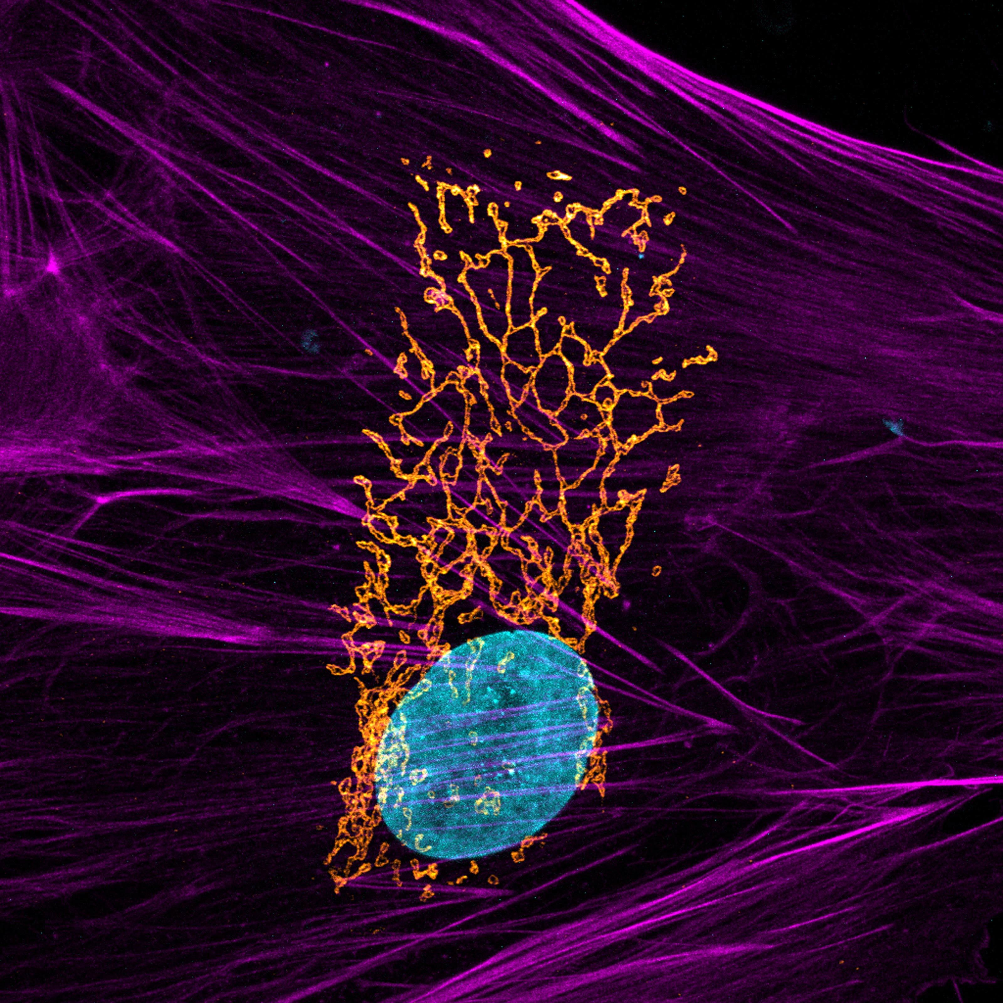 Migrating human fibroblast stained for the Golgi the actin cytoskeleton ...