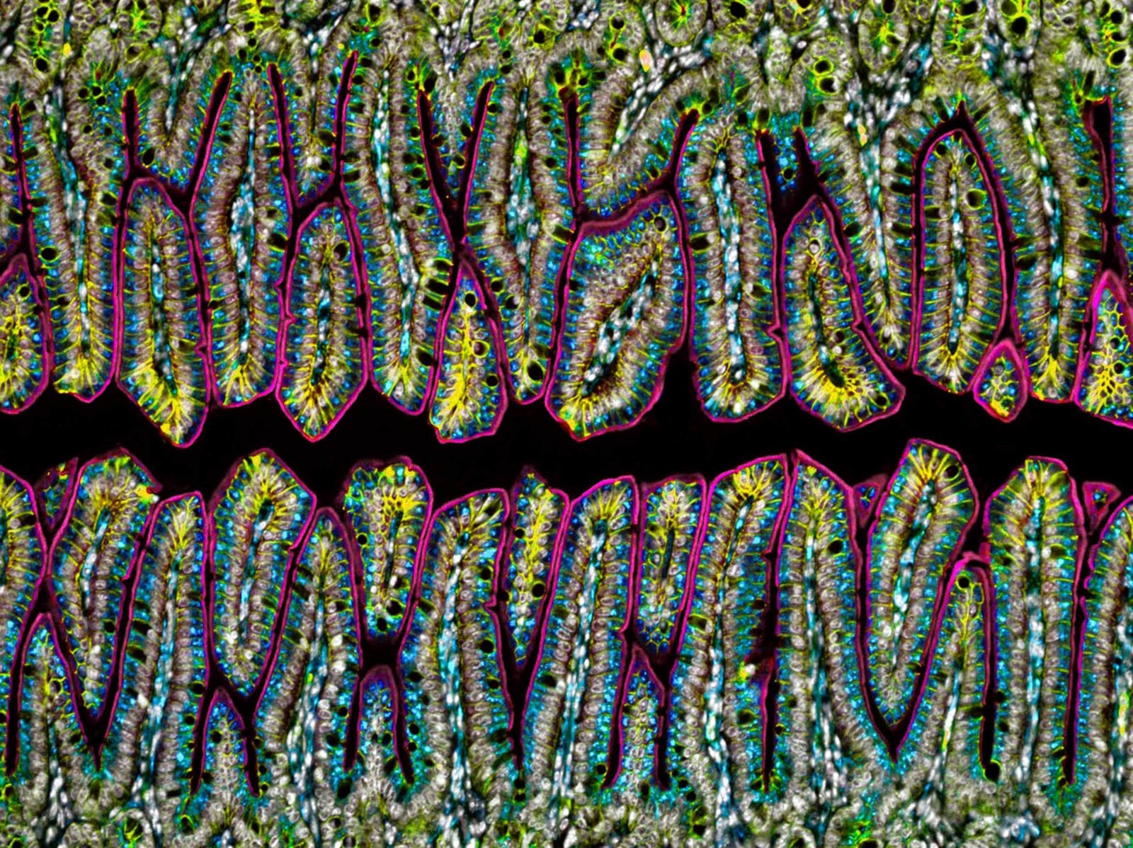 Intestinal villi (brush border in magenta) | Nikon Small World