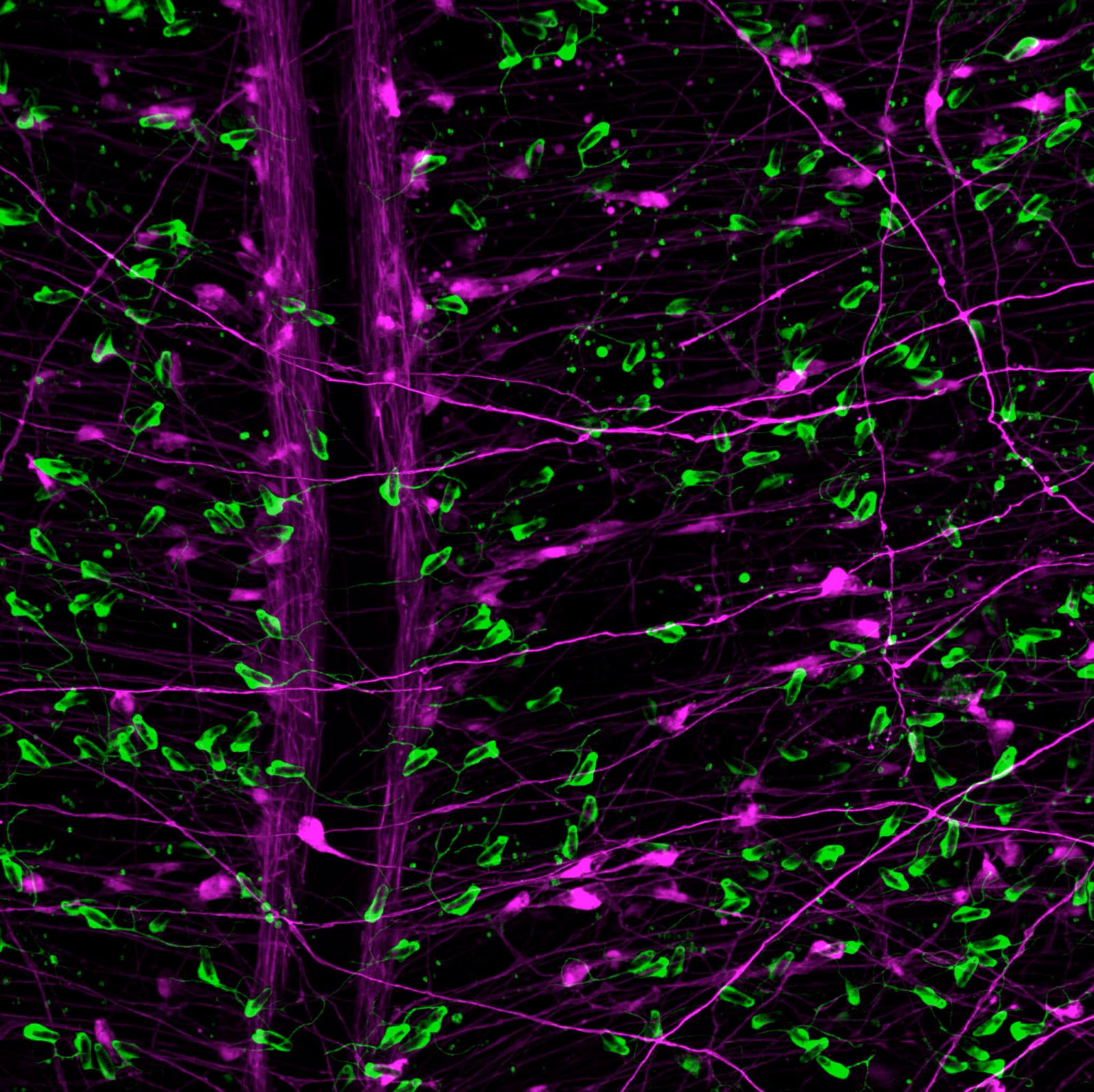 Sea anemone neurons and stinging cells showing their dynamic processes ...
