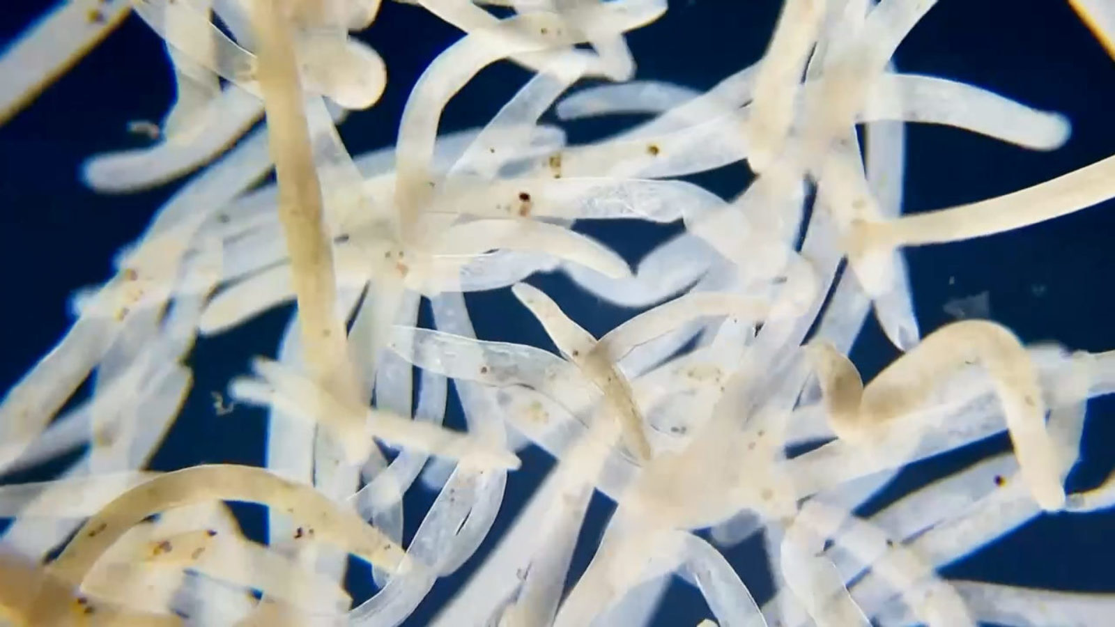 Spirostomum sp. ciliates swimming | Nikon Small World