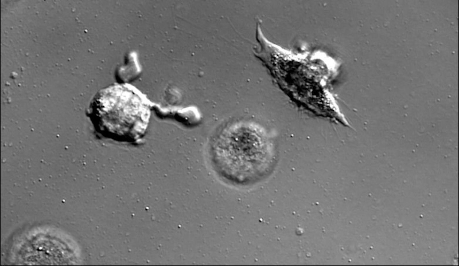 Dying melanoma cells | Nikon Small World