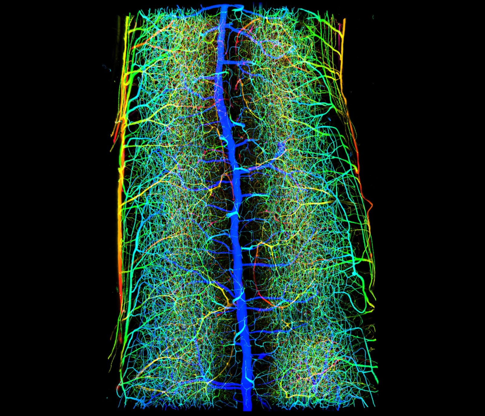 3D imaging of the vasculature network in an adult mouse spinal cord ...