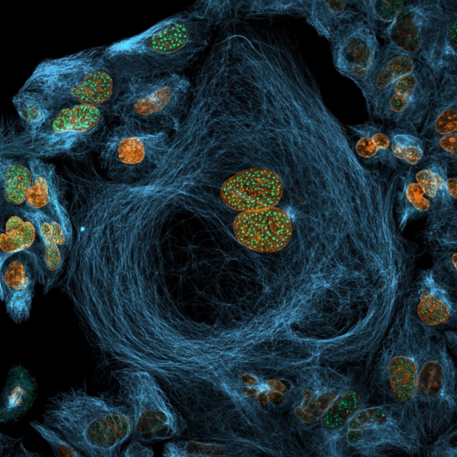 Human lung cell expressing antiviral Mx1 protein, microtubules and ...