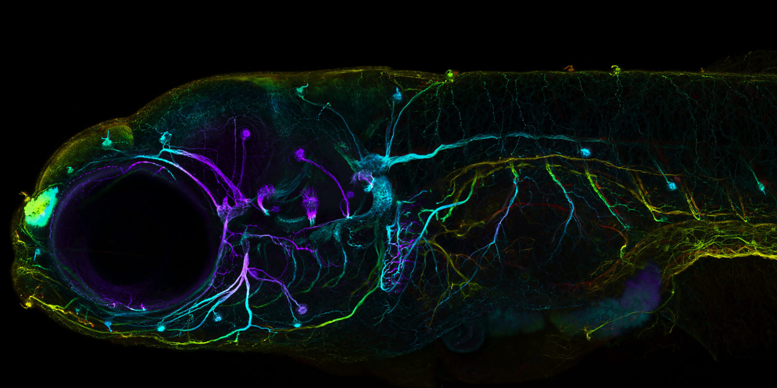 Developing nervous system of a zebrafish | Nikon Small World