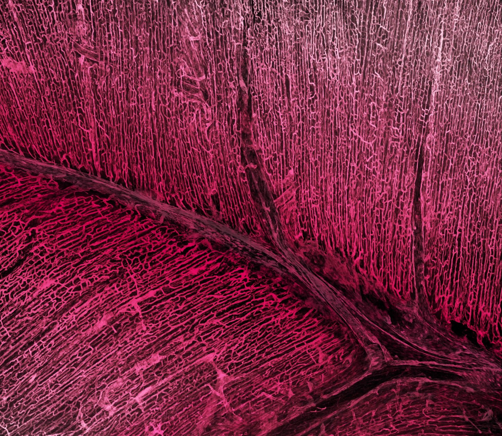 Blood vessels in the diaphragm of a 9-day-old mouse pup | Nikon Small World