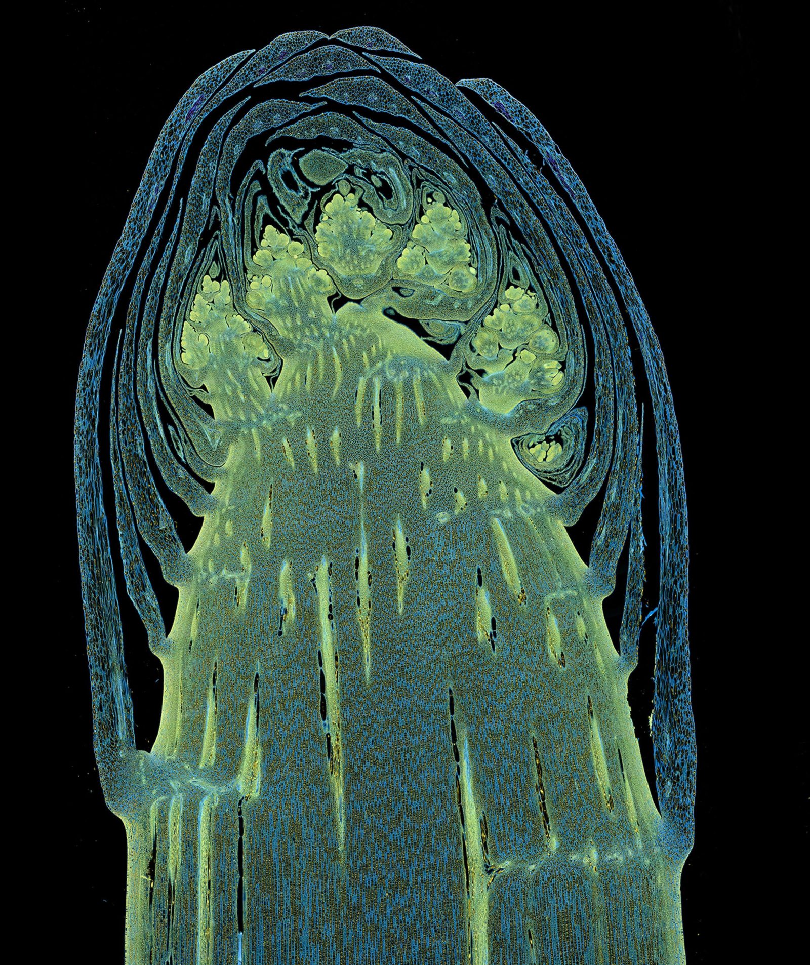 Longitudinal section through a white asparagus shoot tip | Nikon Small ...