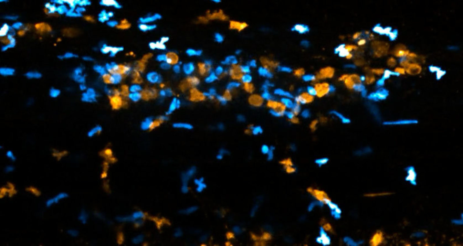 Neutrophils and Macrophages within the granuloma of a zebrafish model ...