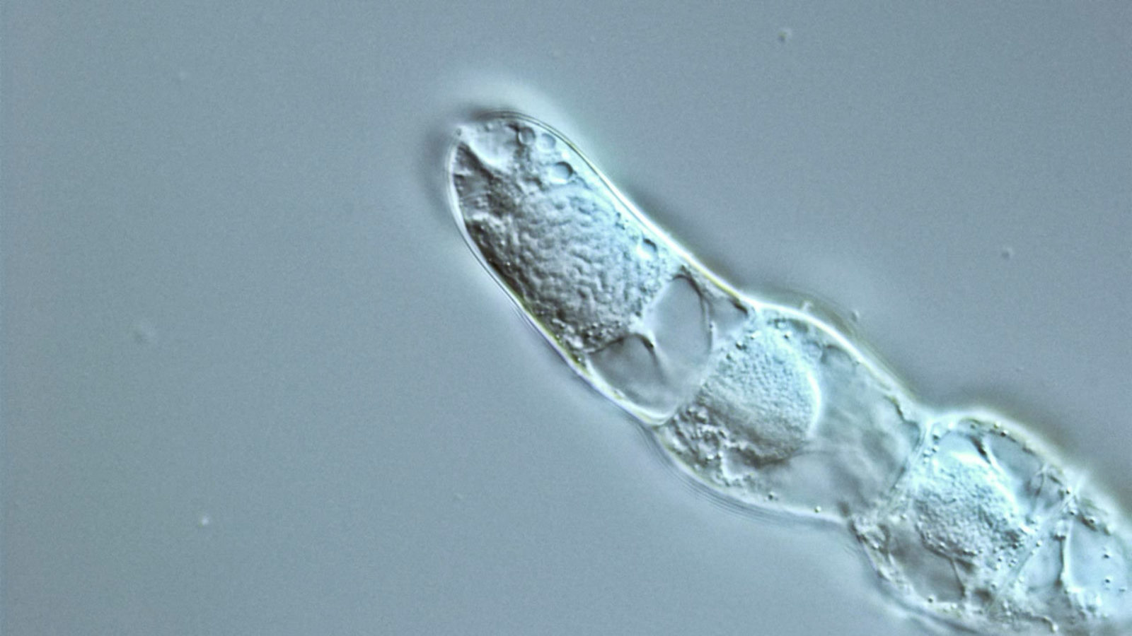 Virginia spiderwort (Tradescantia virginiana) stamen hair cell division ...