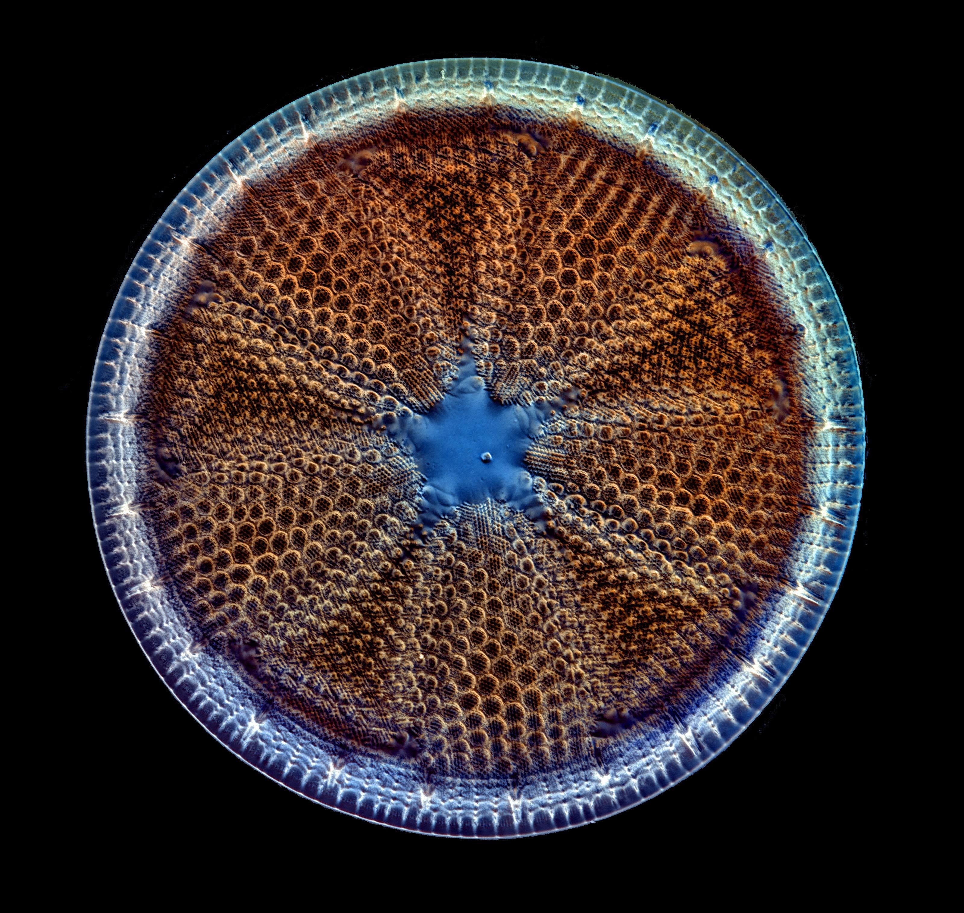 Diatom (Actinoptychus sp.) | Nikon Small World