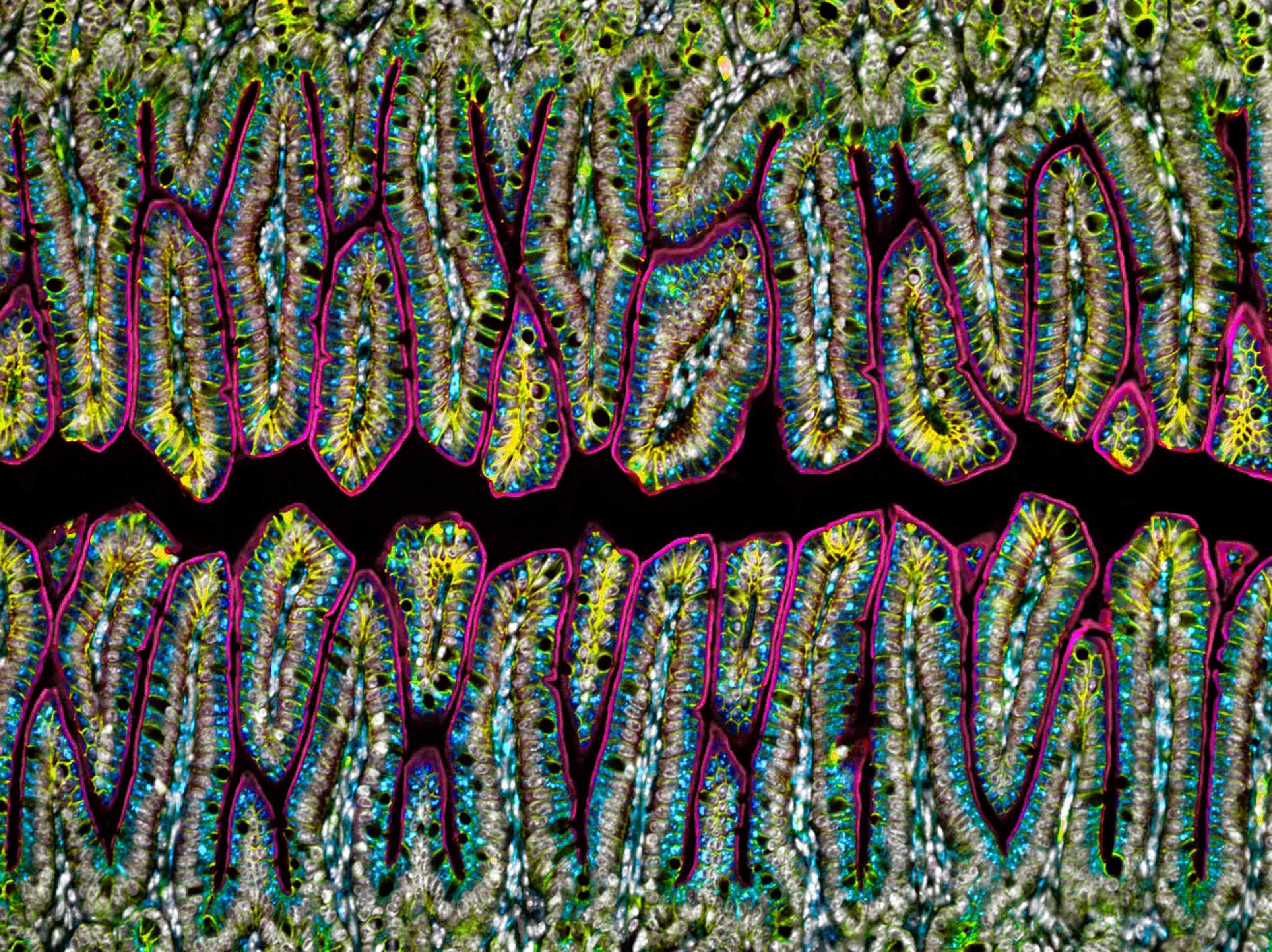 Intestinal villi (brush border in magenta) | Nikon Small World