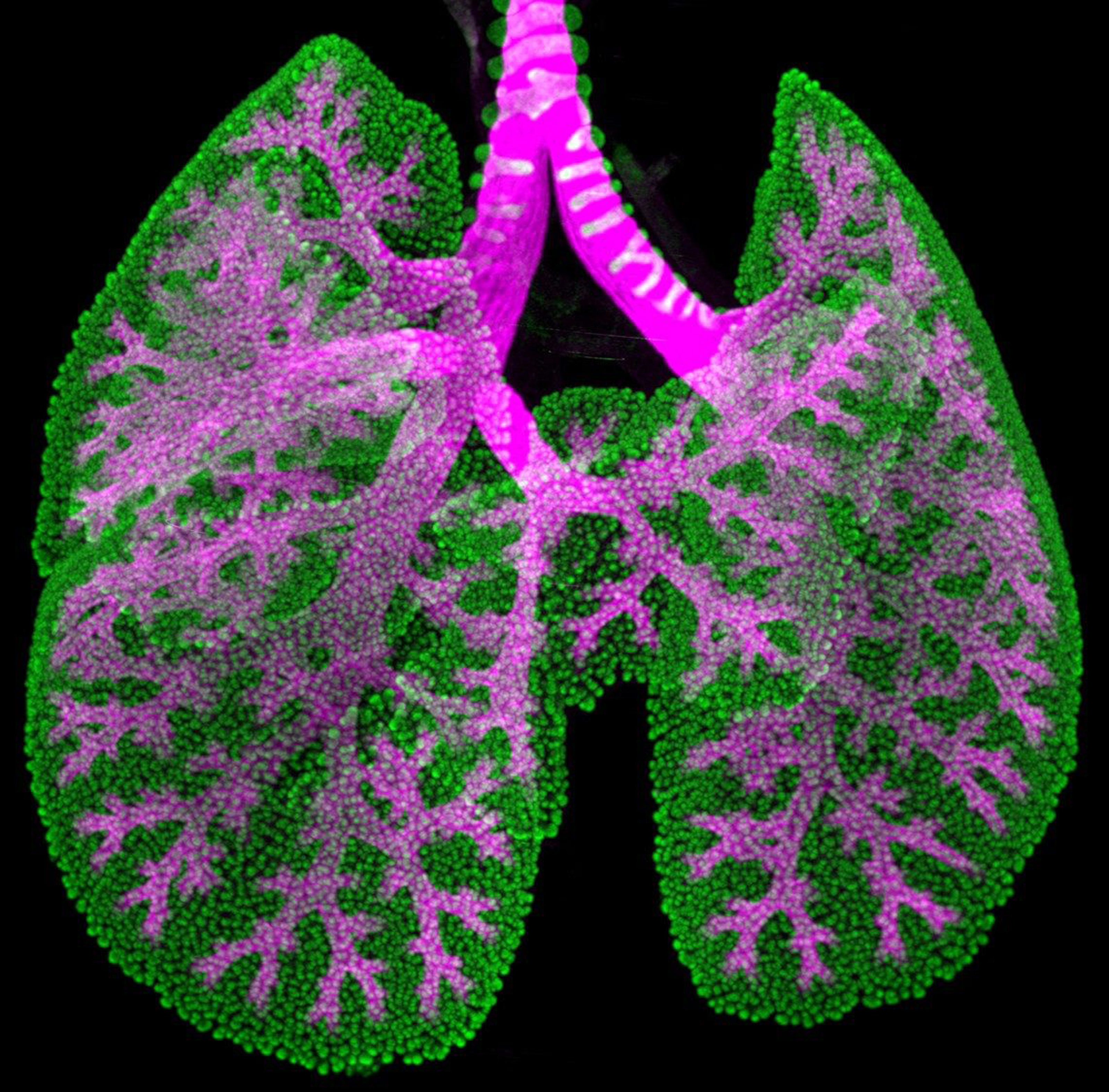 Lung of a 16.5 day old embryonic mouse | Nikon Small World