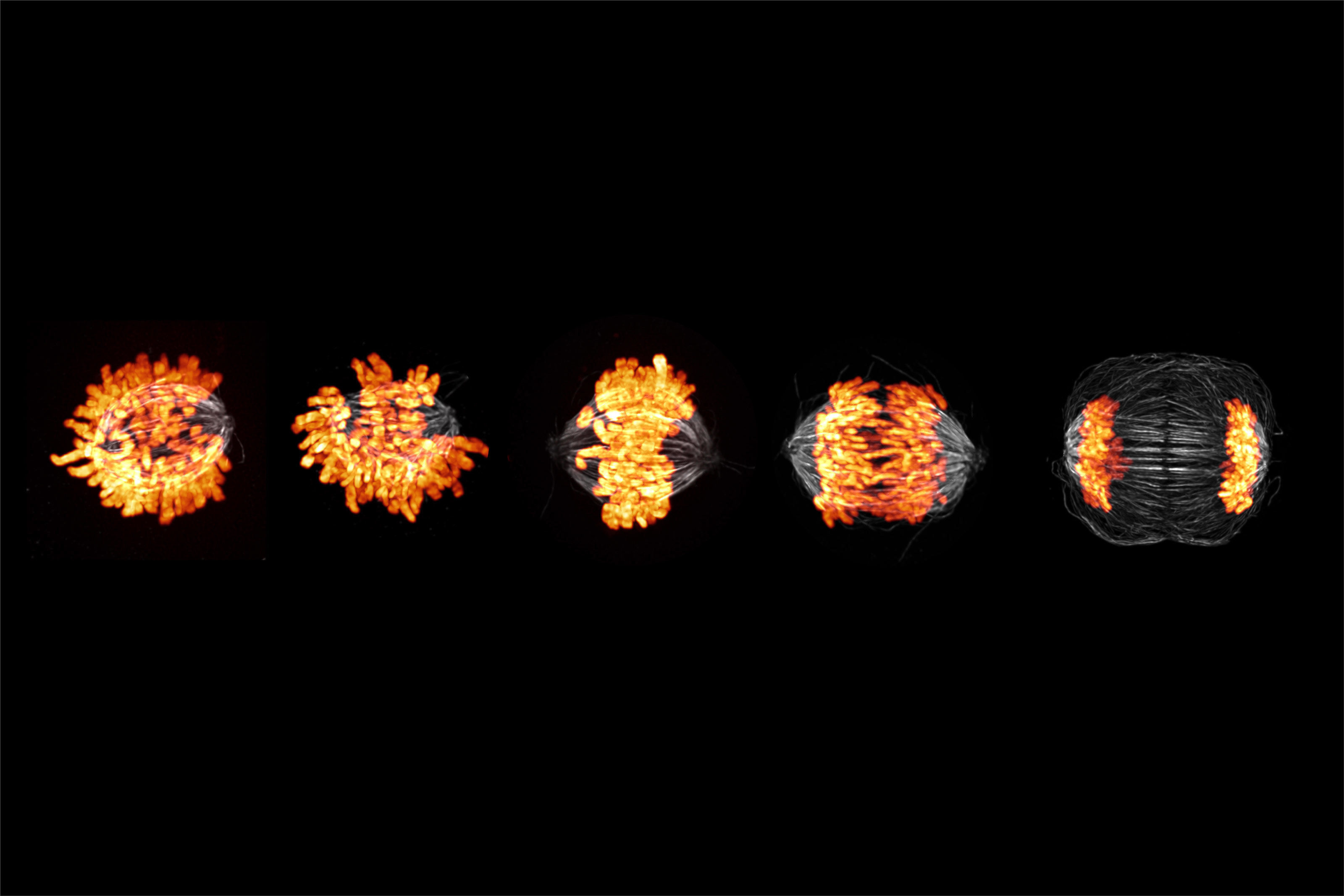 Montage of human cells in different stages of mitosis | Nikon Small World