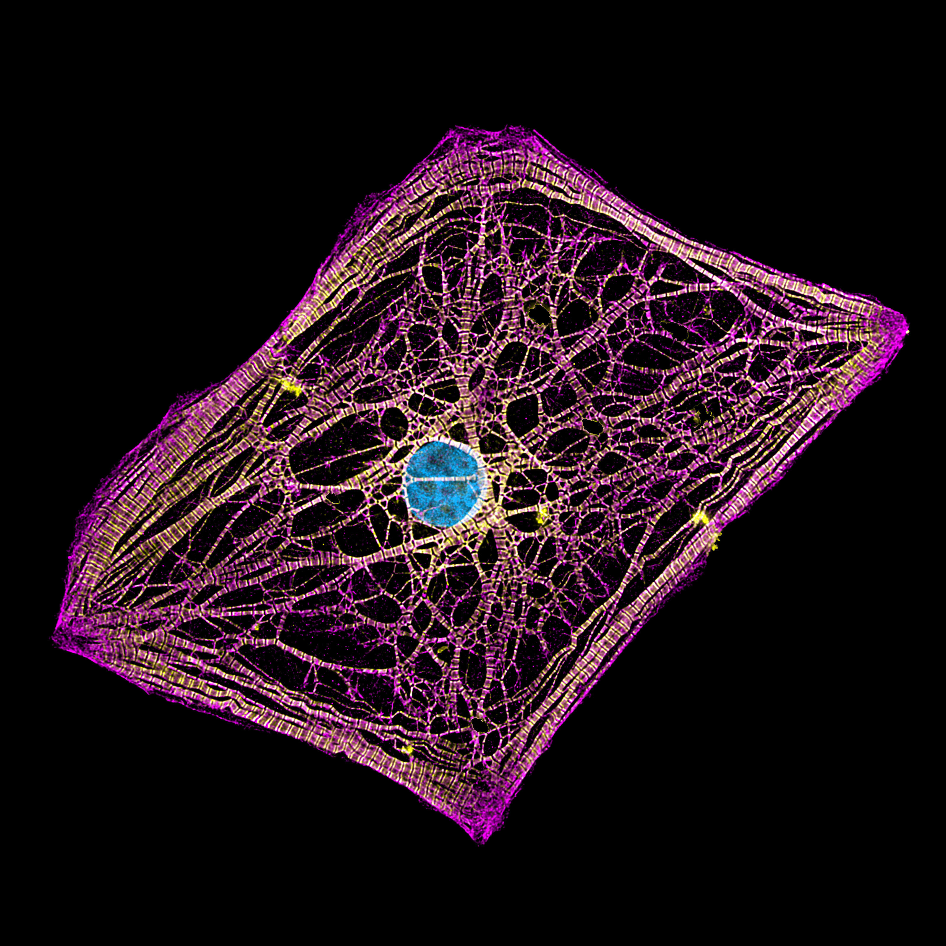 Human cardiomyocytes (heart cells) derived from induced pluripotent ...