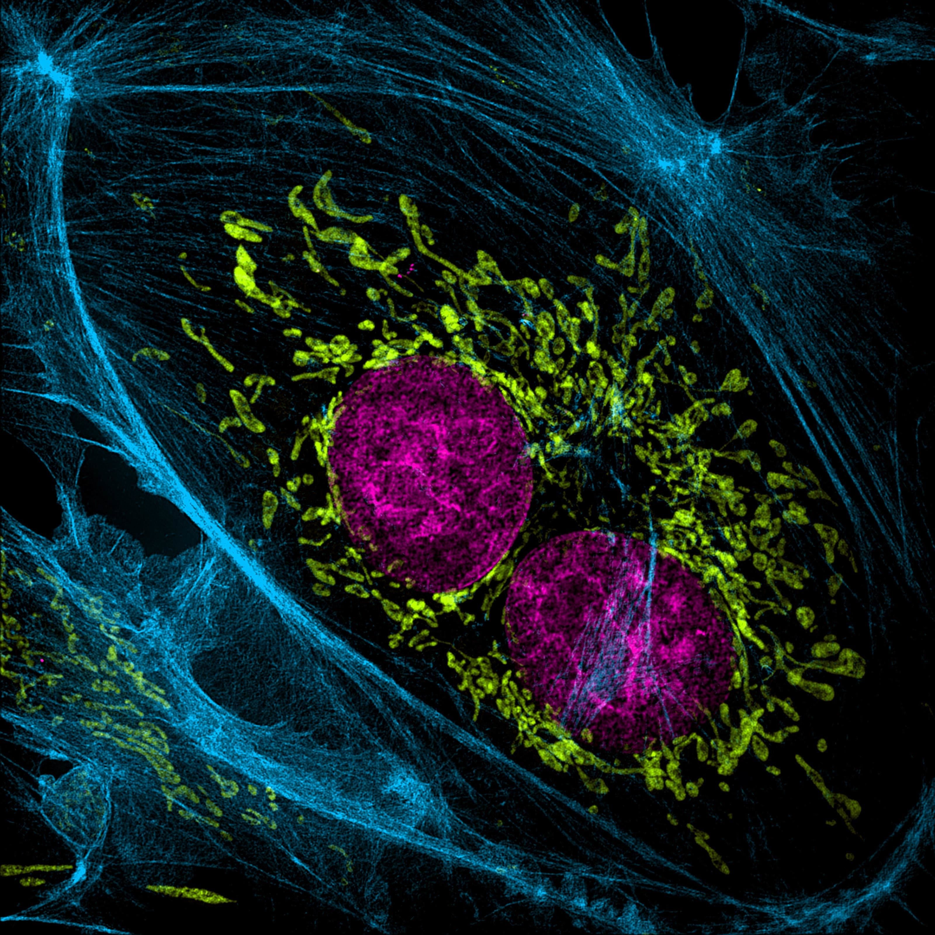 A double nuclei Bovine Pulmonary Artery Endothelial (BPAE) cell | Nikon ...