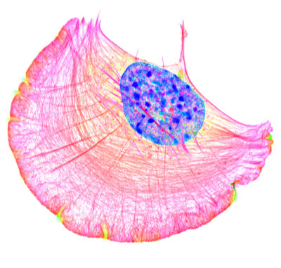 A crawling cell | Nikon Small World