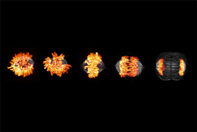 Montage of human cells in different stages of mitosis | Nikon Small World
