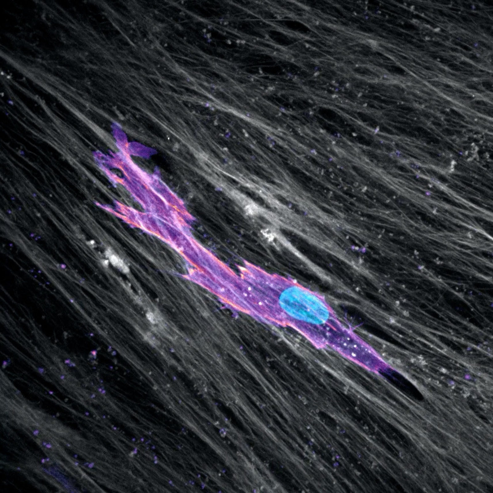 Fibroblast migrating through 3D cell derived matrix marking the actin ...
