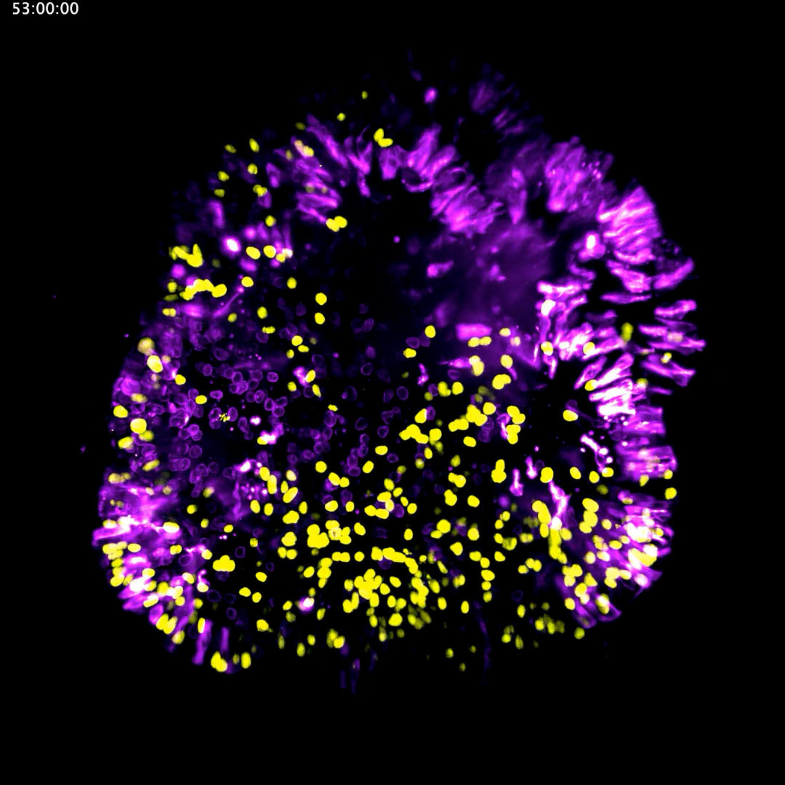 A human brain organoid showing lumen morphogenesis and emergence of ...