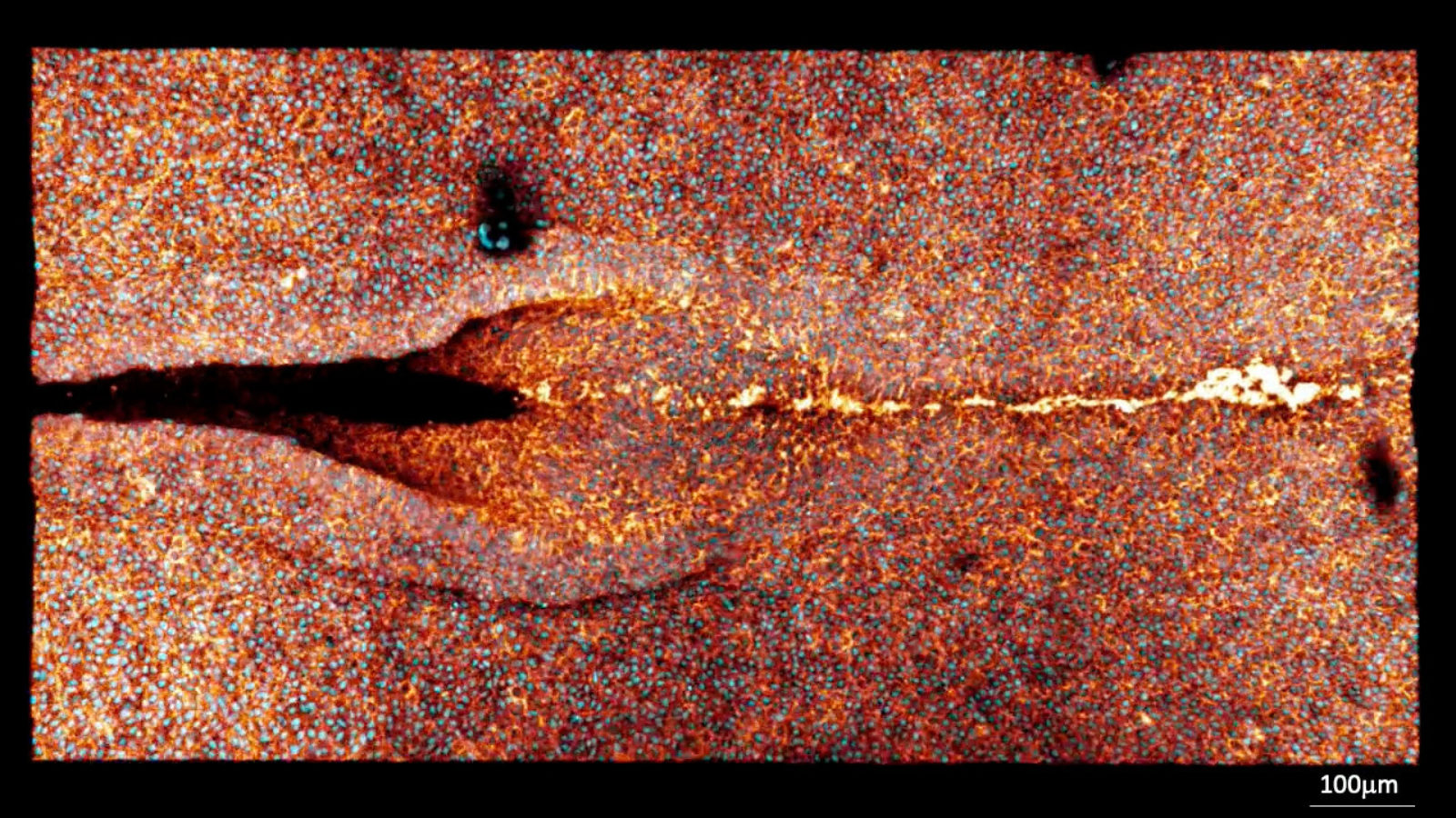 Early nervous system formation in a quail embryo | Nikon Small World