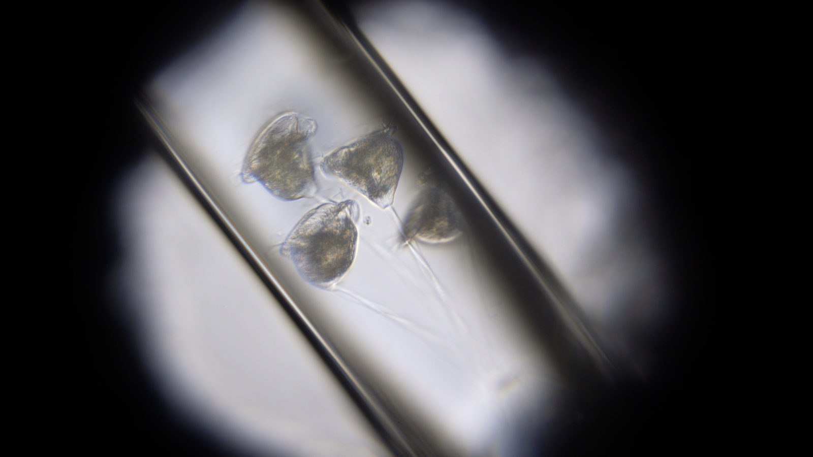 Bell animalcules (Vorticella) | Nikon Small World