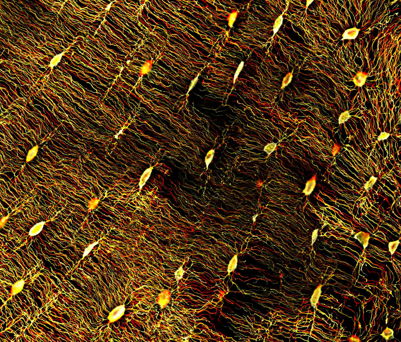 Mouse femur bone lacunar-canalicular network | Nikon Small World