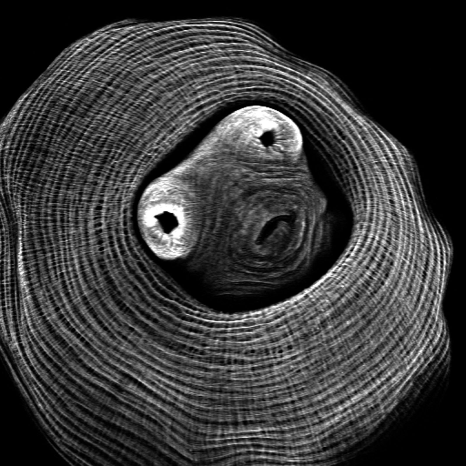 Muscle architecture of a tapeworm Taenia crassiceps cysticercus | Nikon ...
