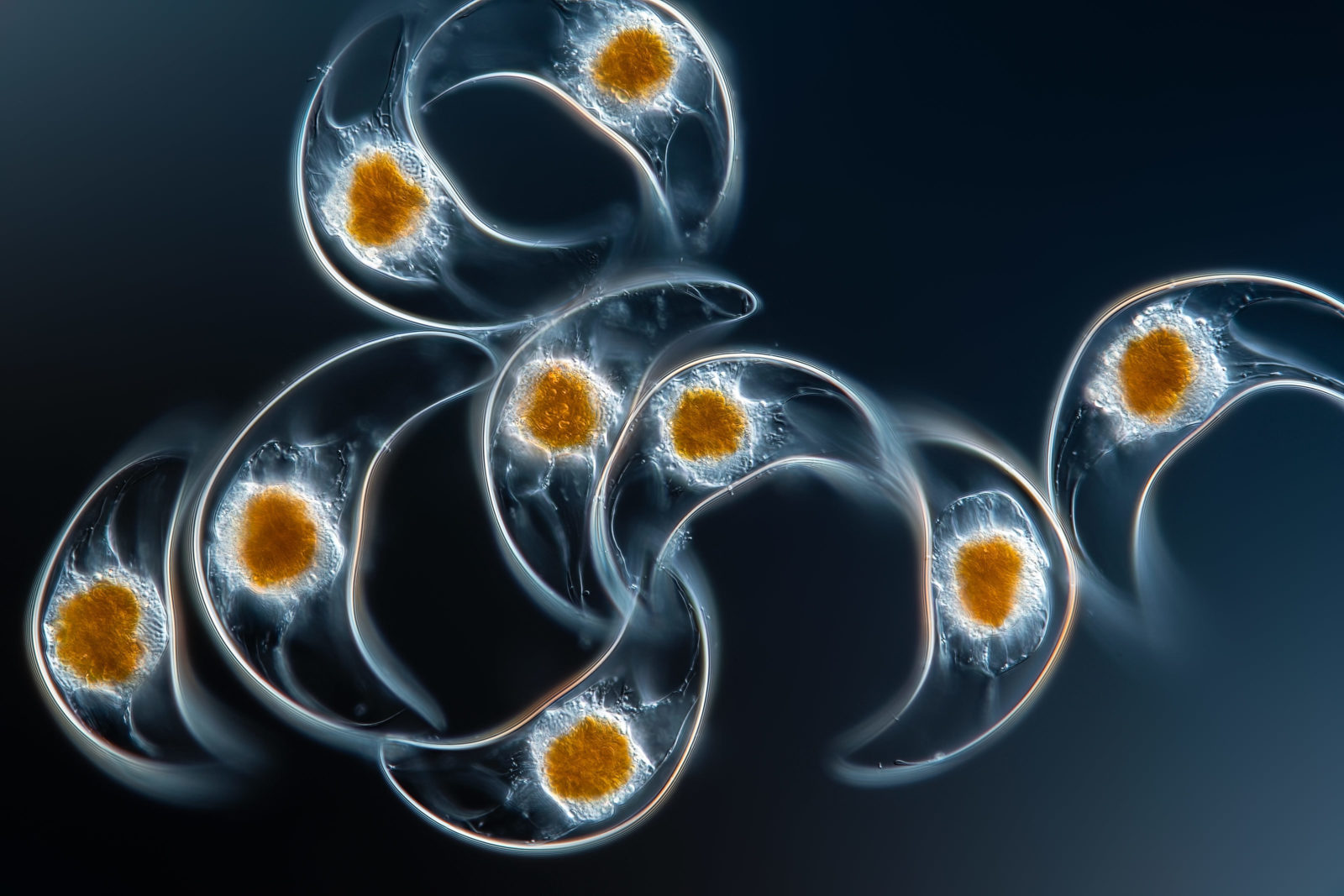 Marine organism (Pyrocystis lunula, Dinophyceae) | Nikon Small World