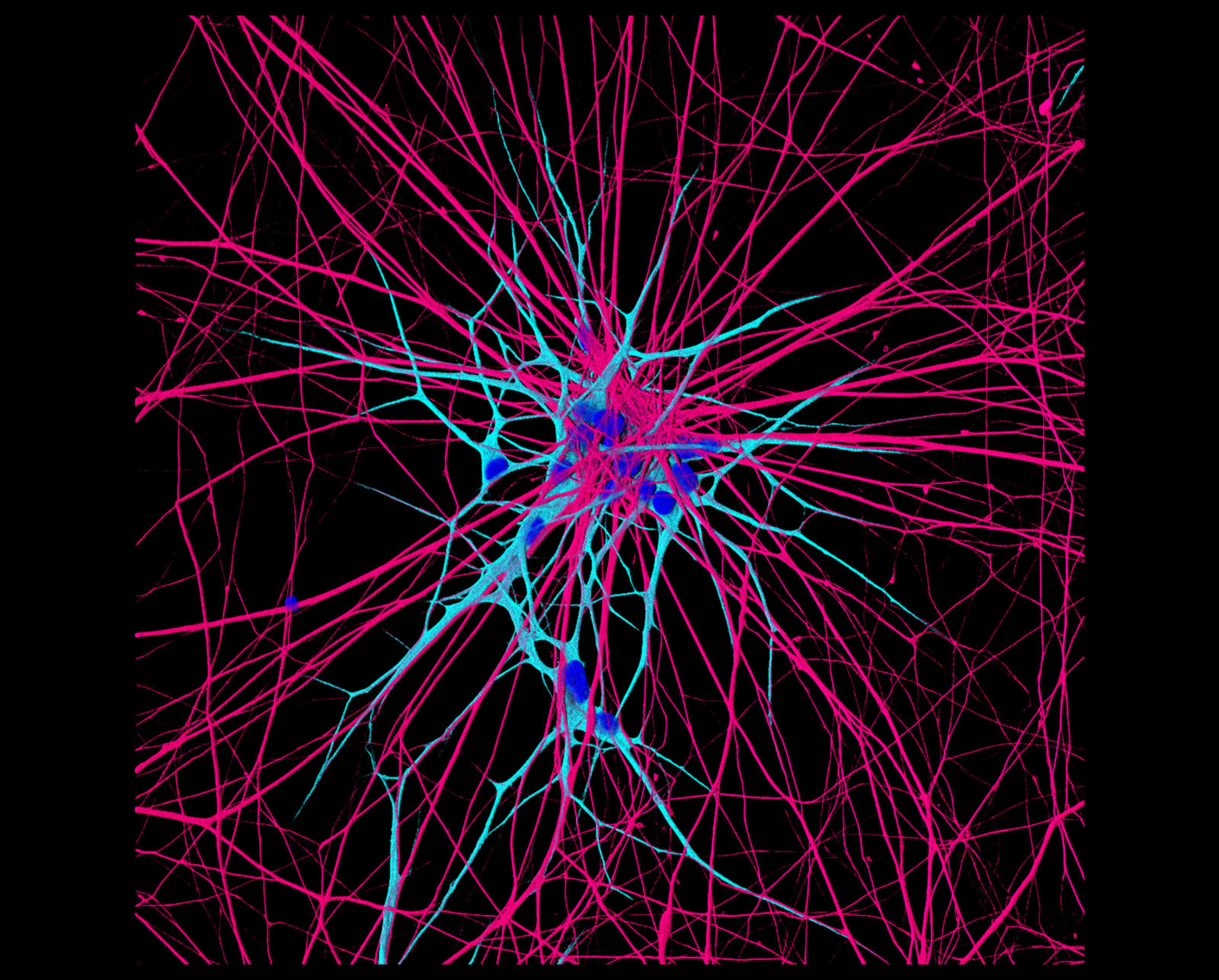iPSC-derived human neurons | Nikon Small World