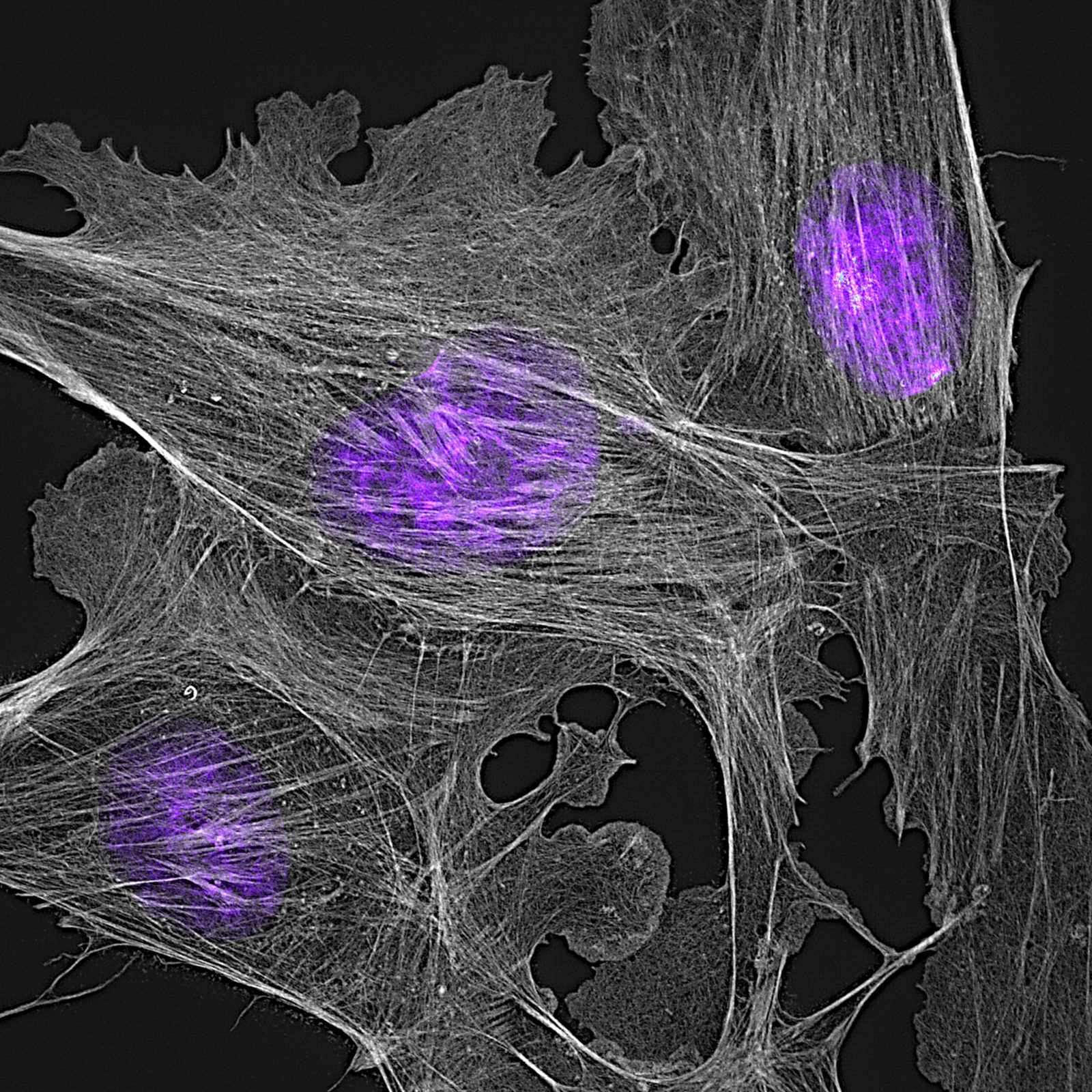 Actin cytoskeleton of bovine pulmonary epithelial cells | Nikon Small World