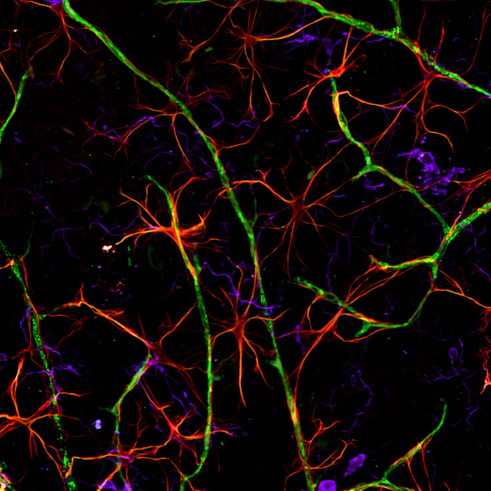 Mouse retina blood vessels (green) astrocytes (red) and microglia ...
