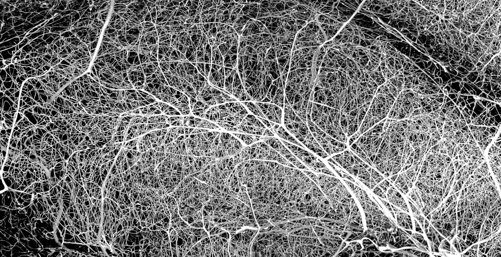 Capillary network section of the mammalian brain | Nikon Small World