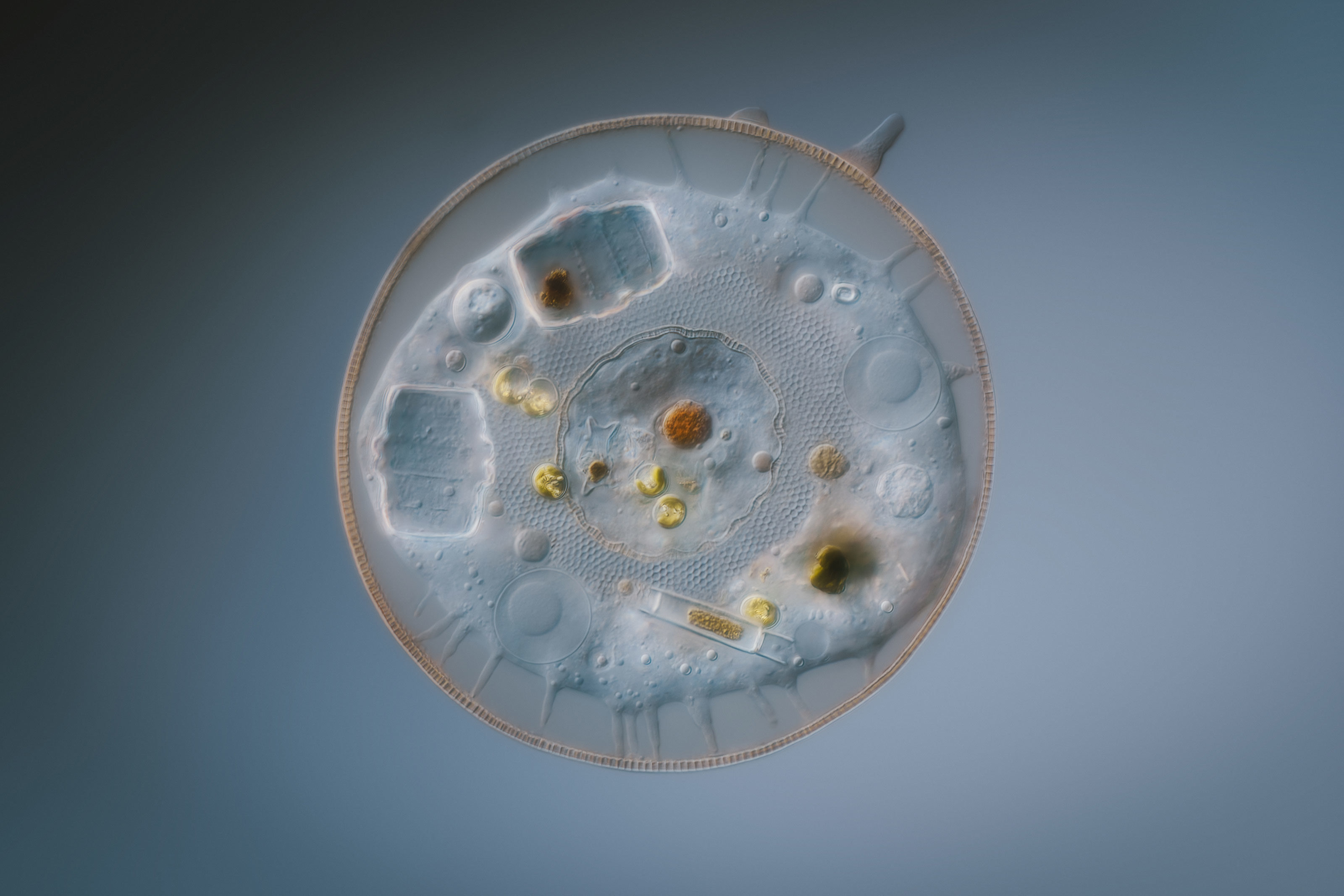 Amoeba (Arcella) | Nikon Small World