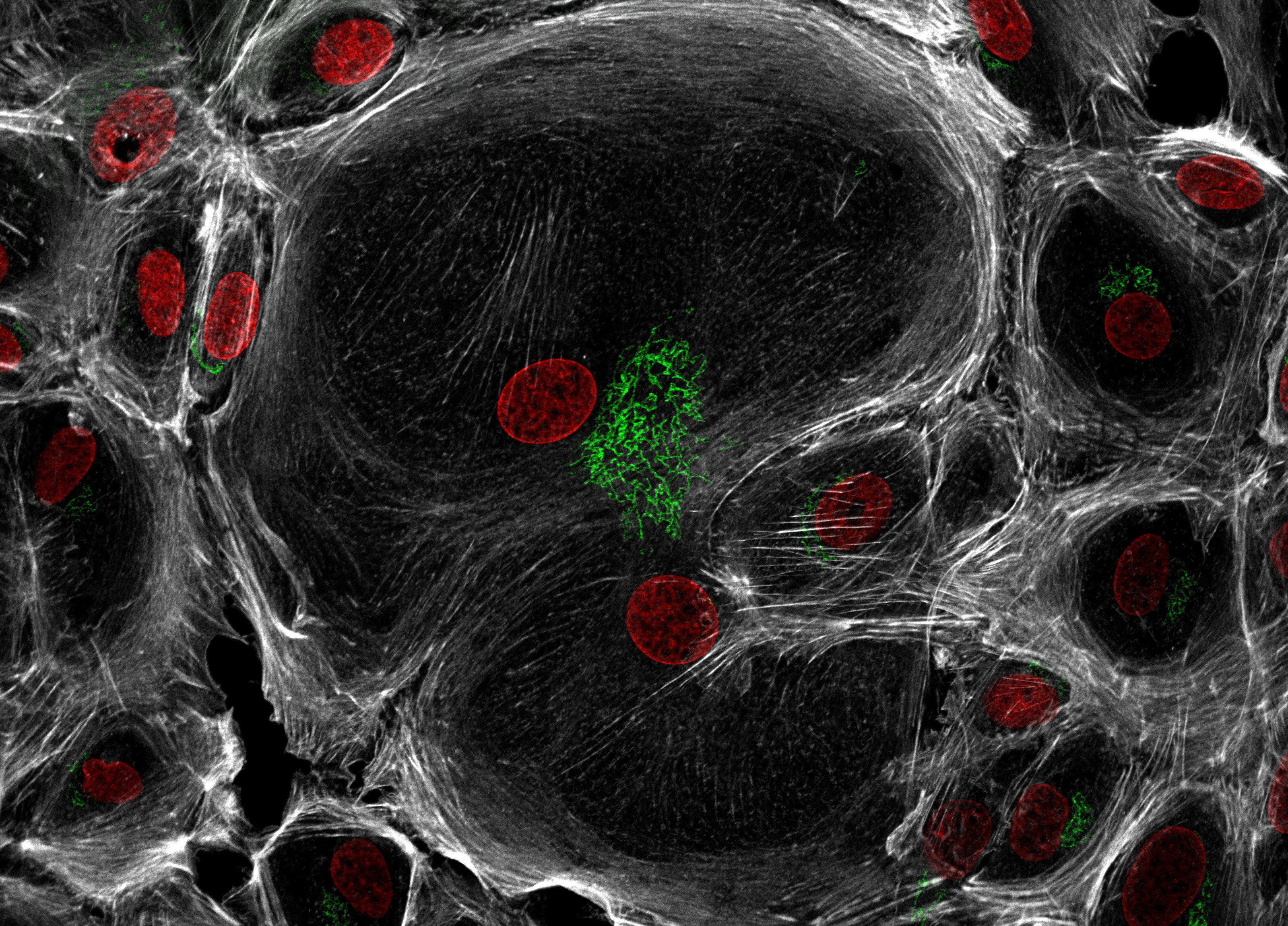 Non-parenchymal liver cells | Nikon Small World